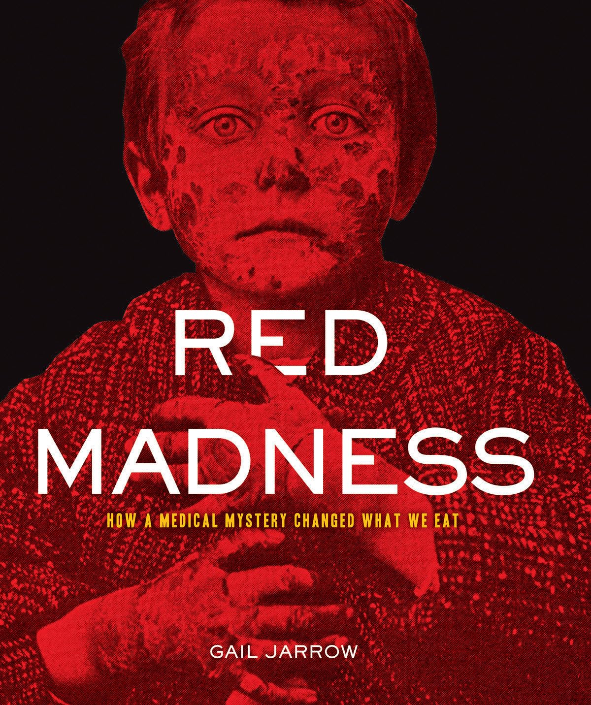 Amazon.com: Red Madness: How a Medical Mystery Changed What We Eat ...