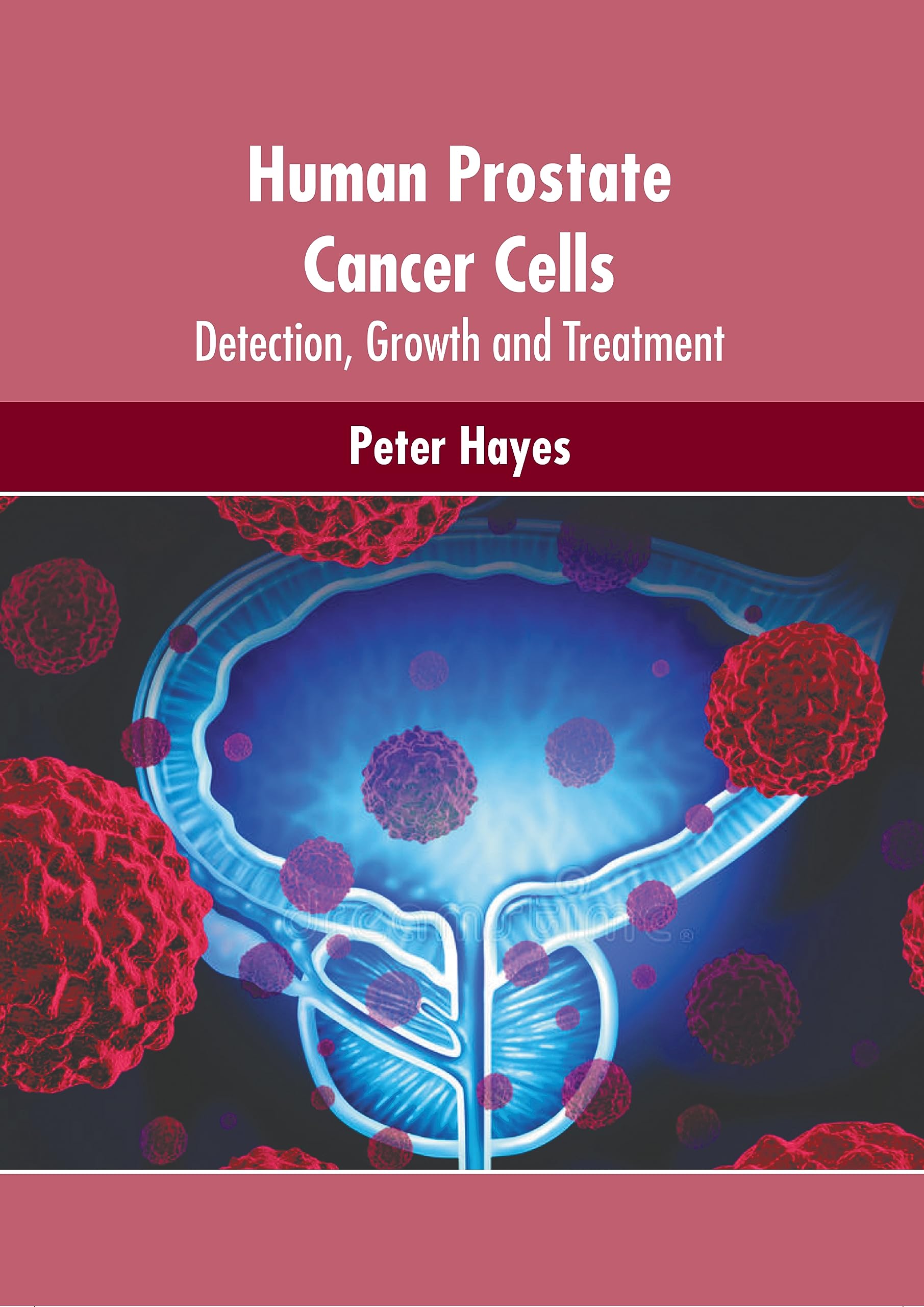 Human Prostate Cancer Cells: Detection, Growth and Treatment ...