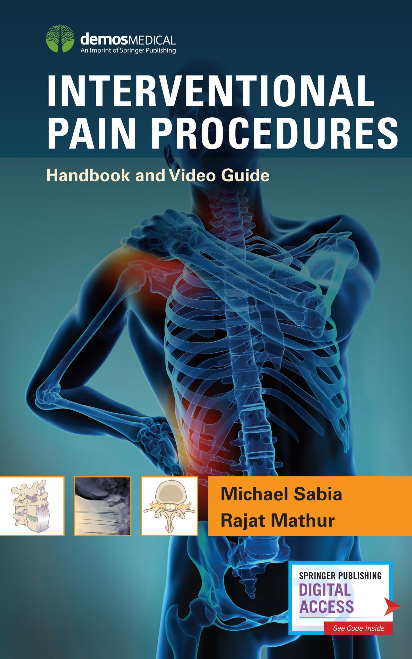 Interventional Pain Procedures: Handbook and Video Guide: 9781620701027 ...