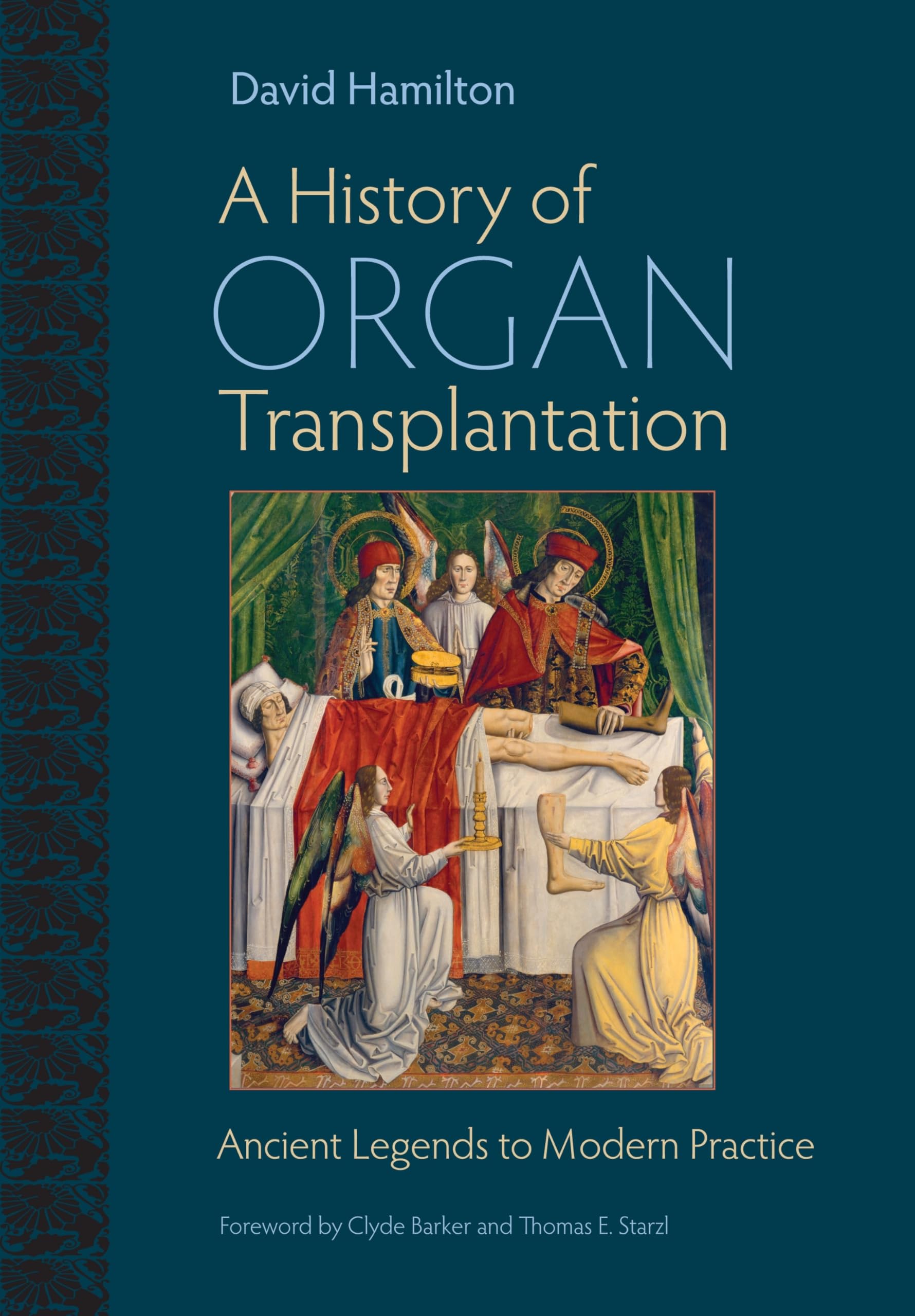 A History of Organ Transplantation: Ancient Legends to Modern Practice ...