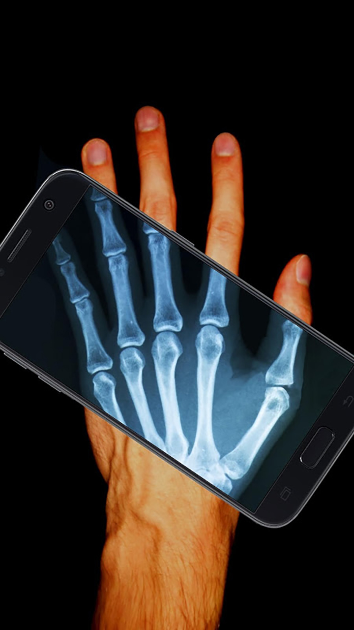Real Xray Body Scan Filter Cam - App on the Amazon Appstore