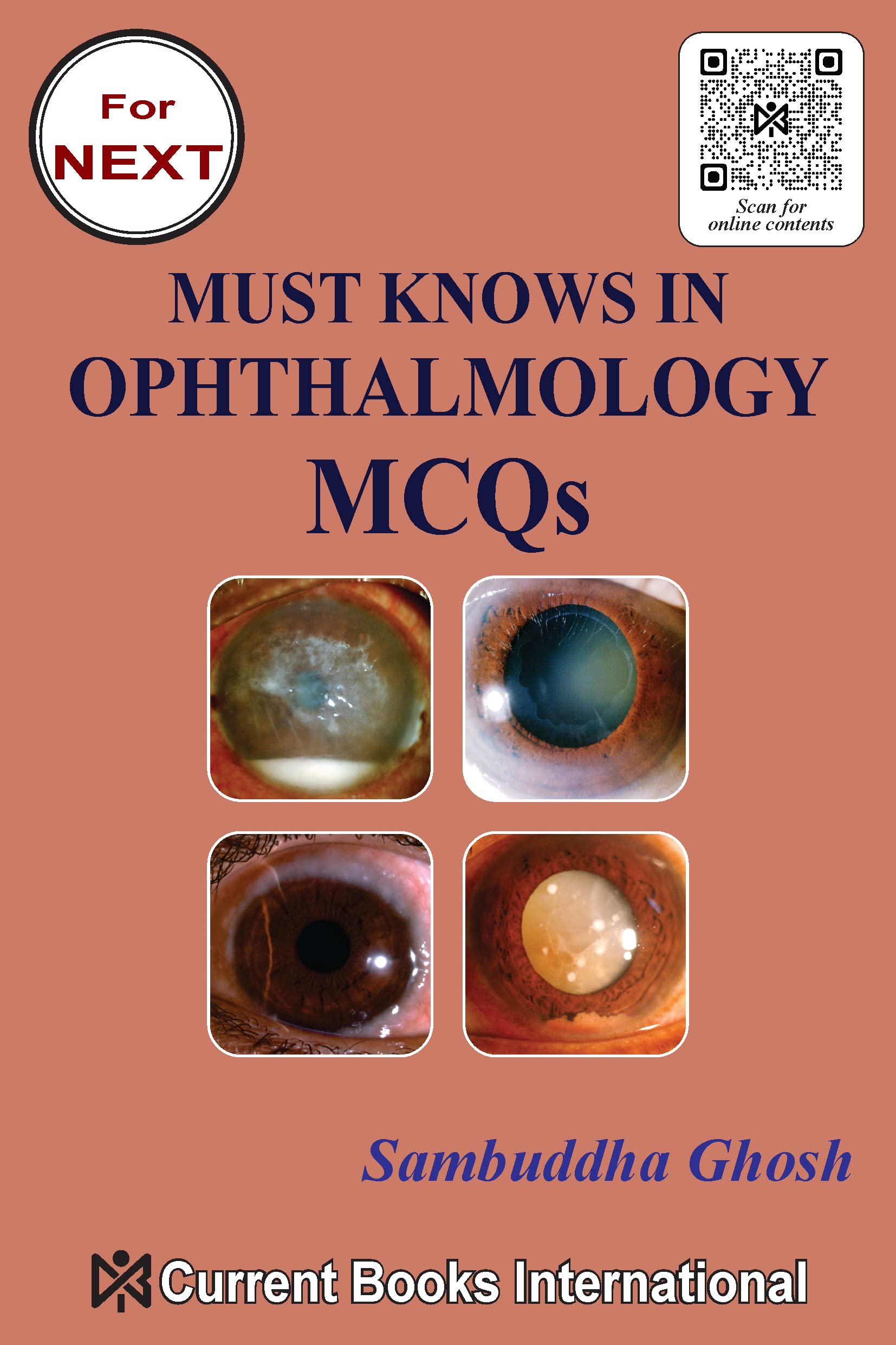 Buy Must Knows in Ophthalmology MCQs Book Online at Low Prices in India ...