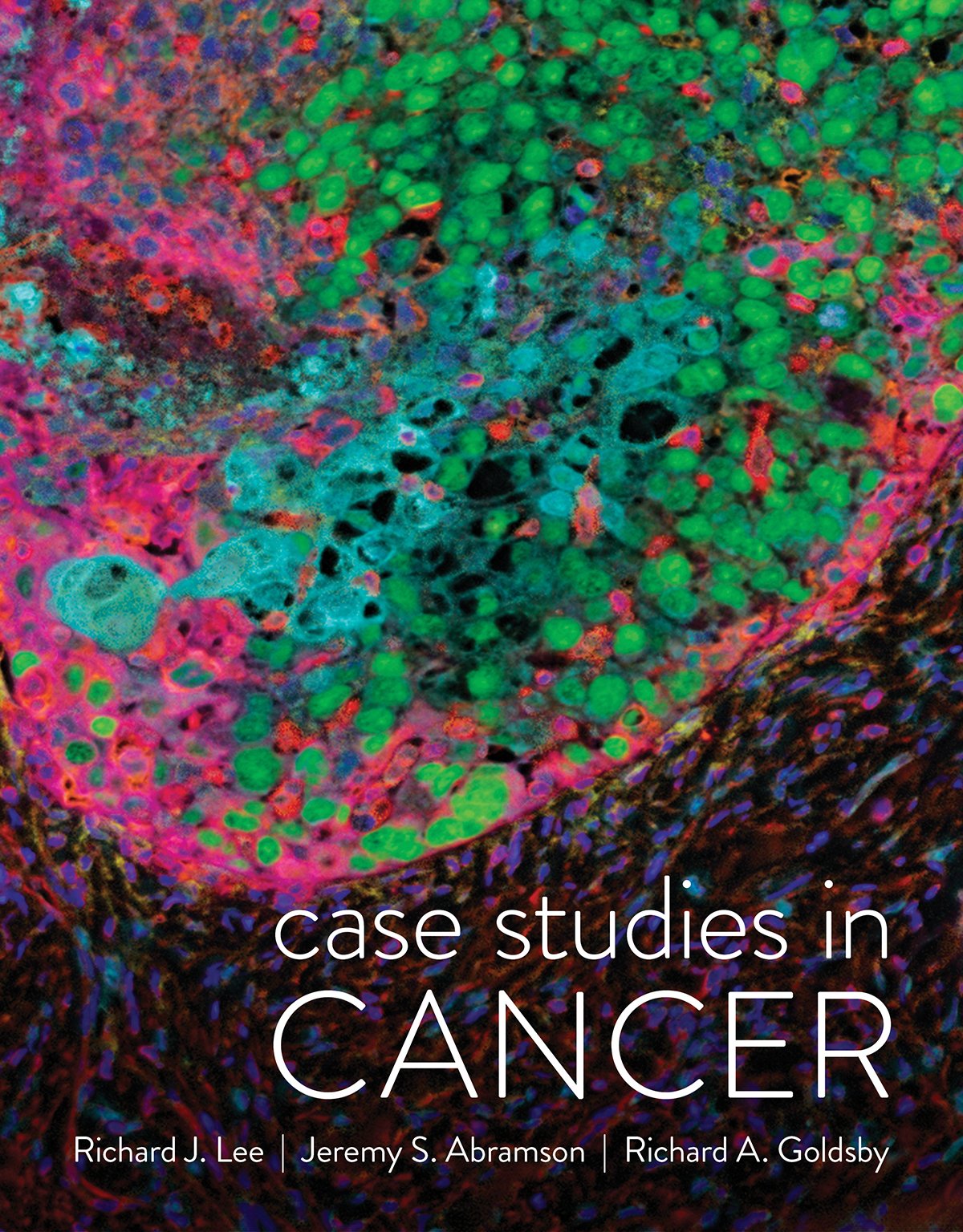 Case Studies in Cancer: 9780393679519: Medicine & Health Science Books ...