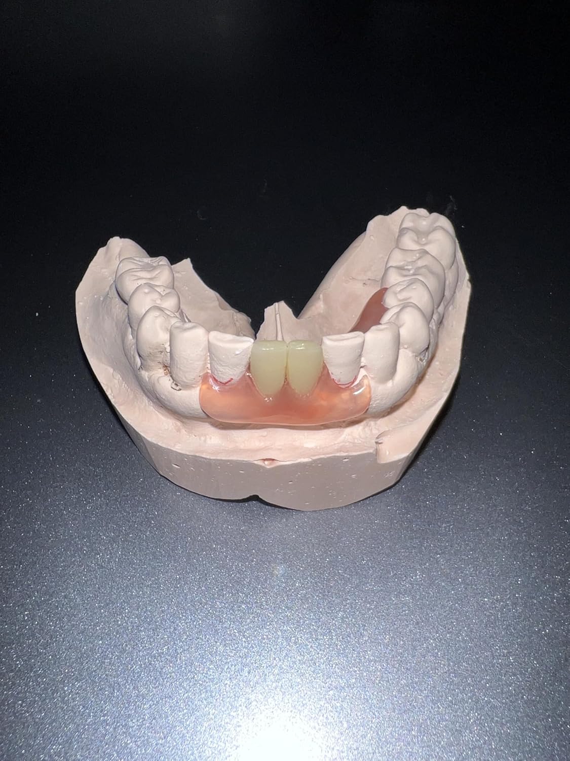 Amazon.com : Flex Nesbit Denture : Health & Household