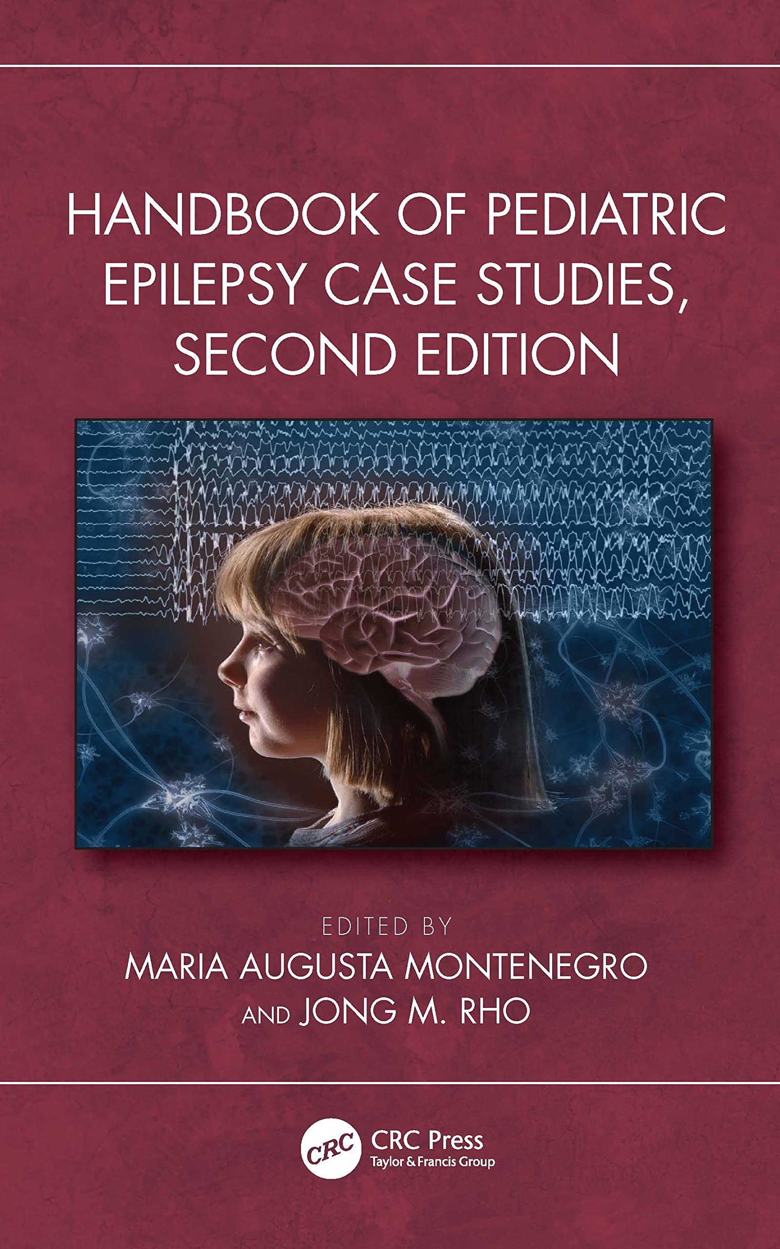 Handbook of Pediatric Epilepsy Case Studies, Second Edition: 9781032283548: Medicine & Health ...