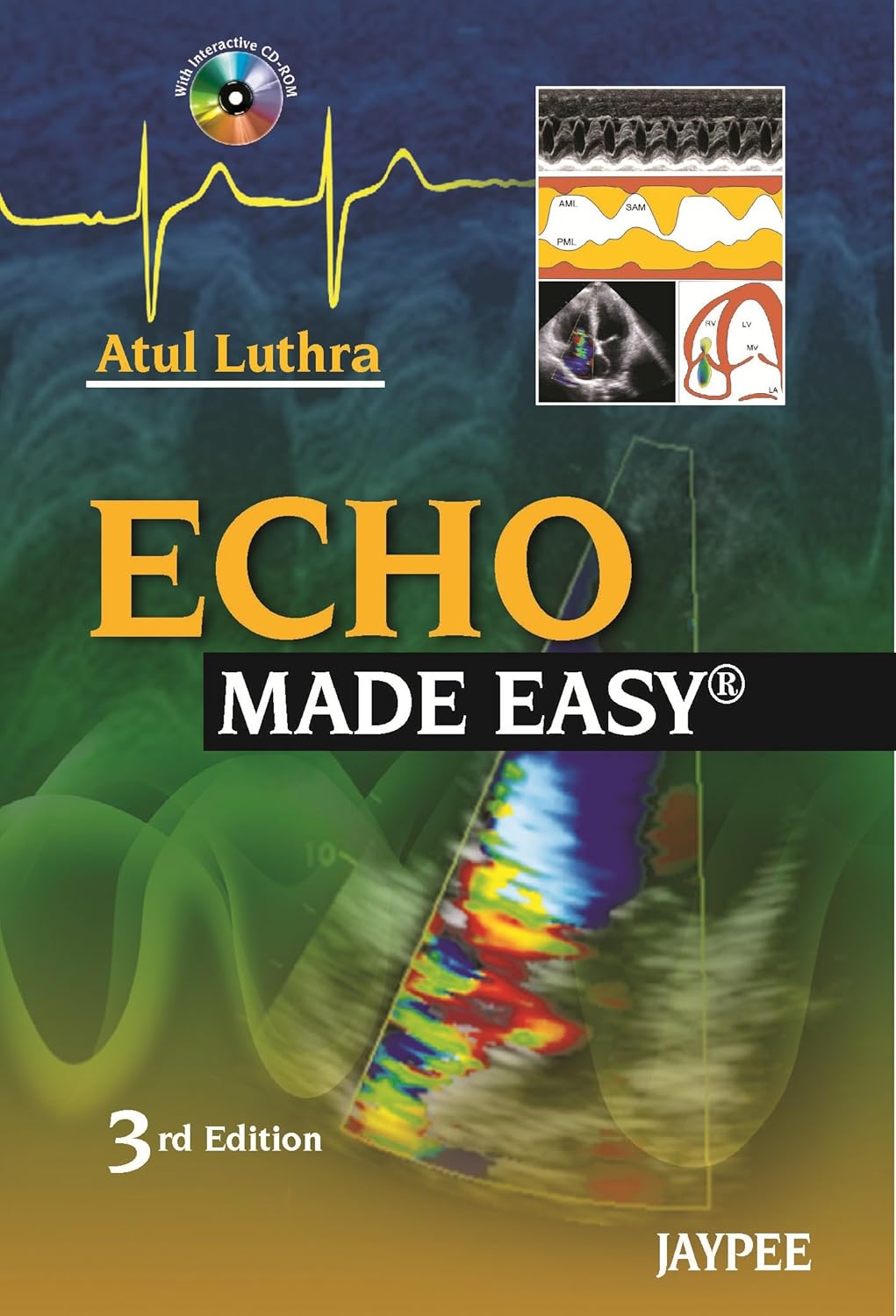 Echo Made Easy: Luthra, Atul: 9788184489392: Amazon.com: Books
