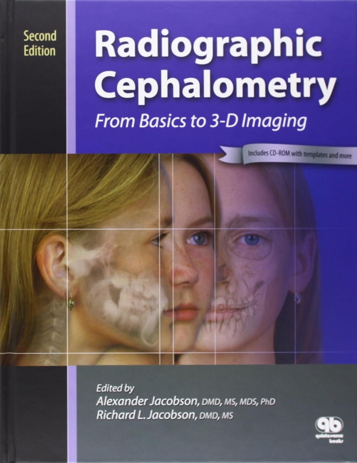 Radiographic Cephalometry: From Basics to 3-d Imaging - Alexander ...