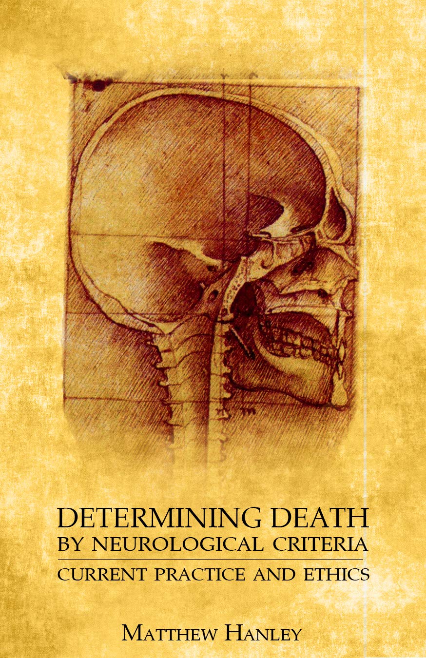 Determining Death by Neurological Criteria: Current Practice and Ethics ...