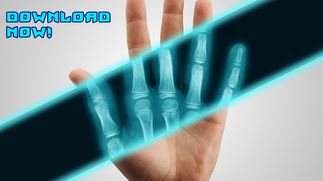 Best X-Ray FREE - App on Amazon Appstore