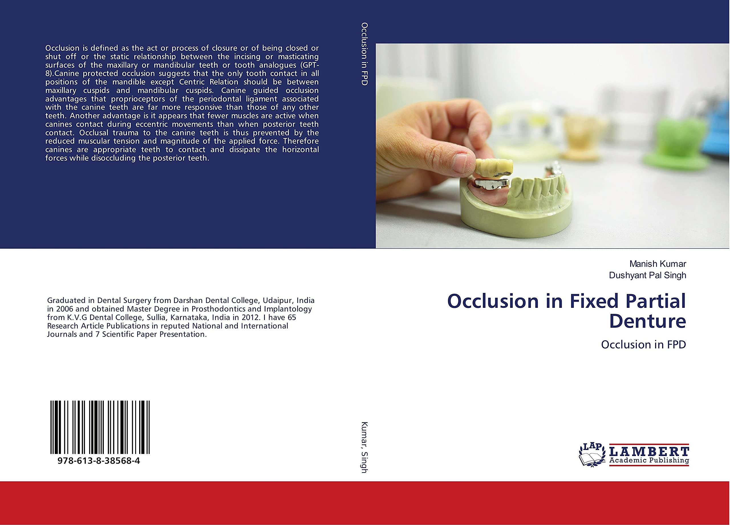 Buy Occlusion in Fixed Partial Denture: Occlusion in FPD Paperback ...