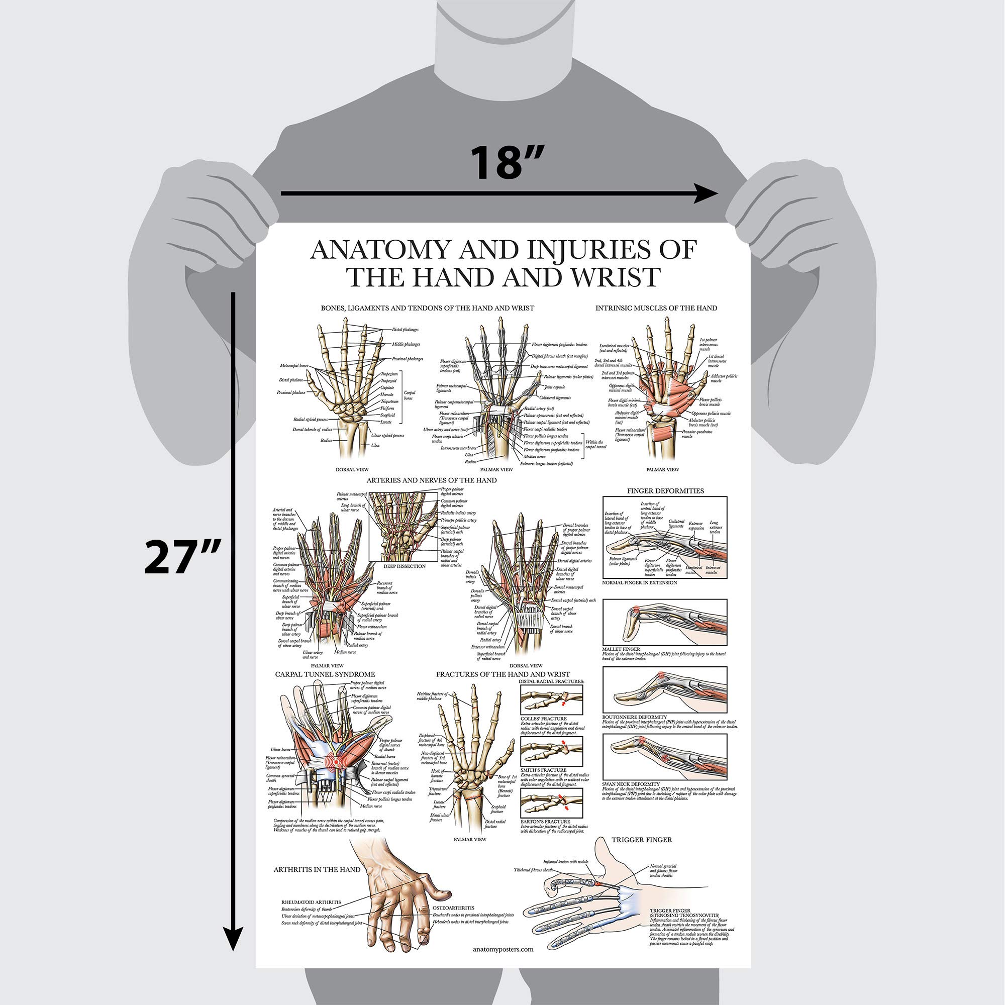 Laminated Anatomy and Injuries of The Hand and Wrist Poster - Hand and ...