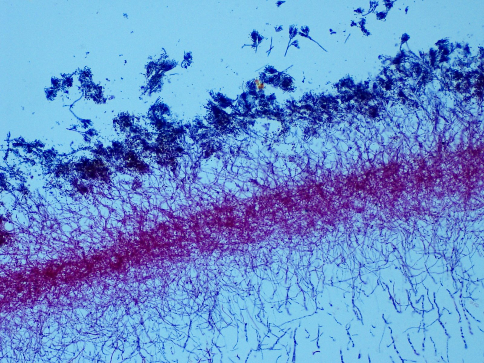Penicillium Slide Labeled