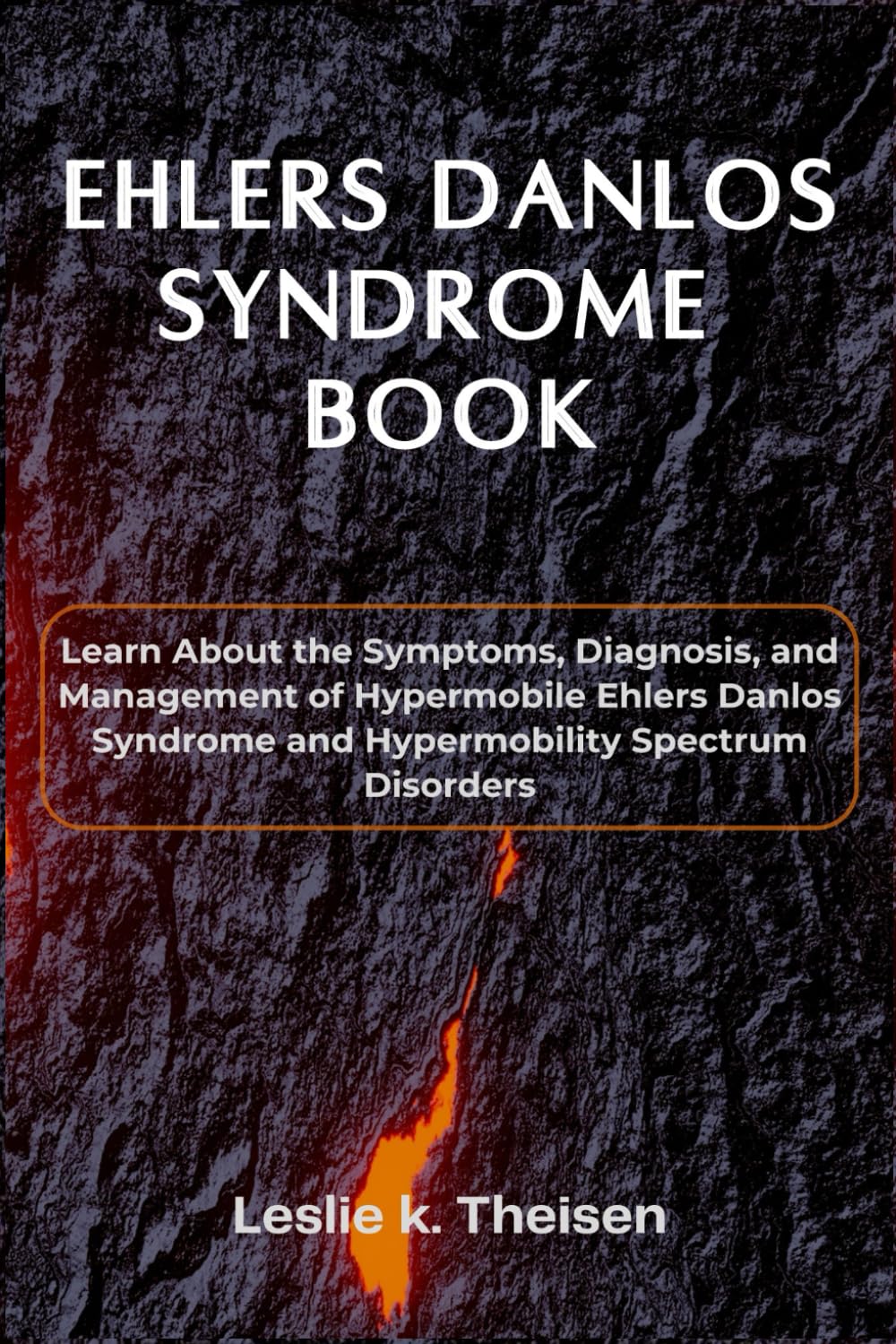 Ehlers Danlos Syndrome book: Learn About the Symptoms, Diagnosis, and ...