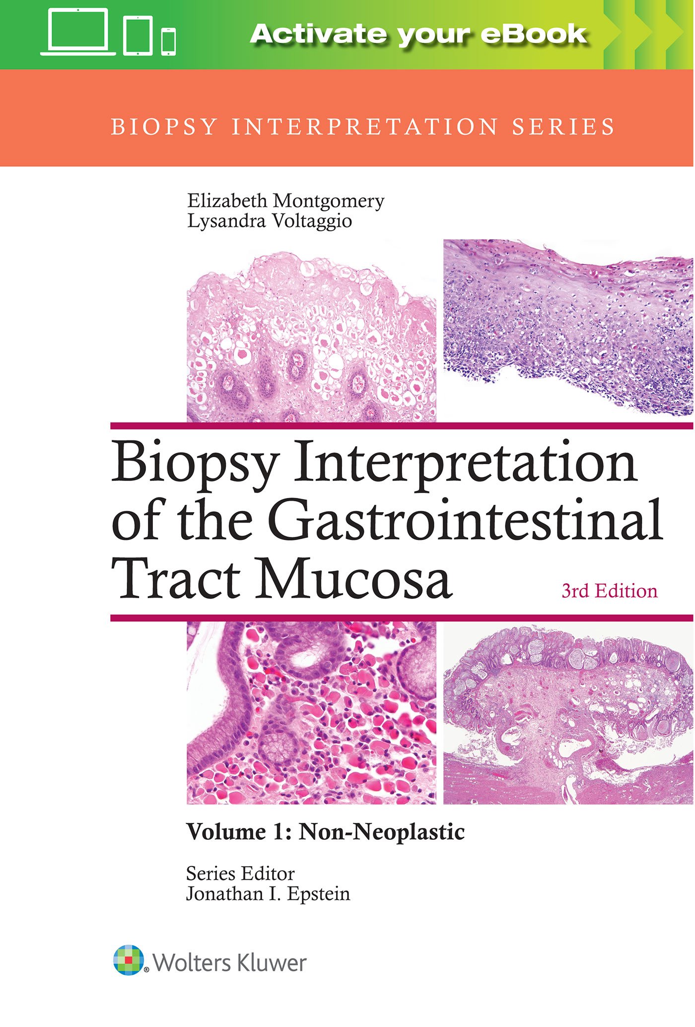 Amazon | Biopsy Interpretation of the Gastrointestinal Tract Mucosa ...