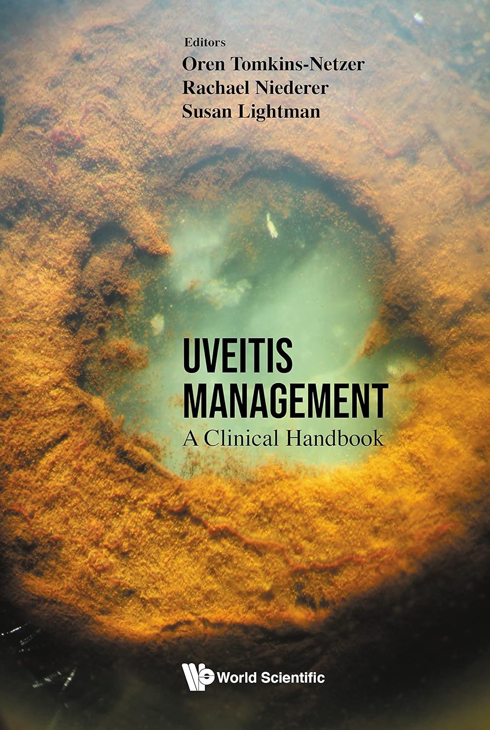 Amazon.com: Uveitis Management: A Clinical Handbook eBook : Oren ...