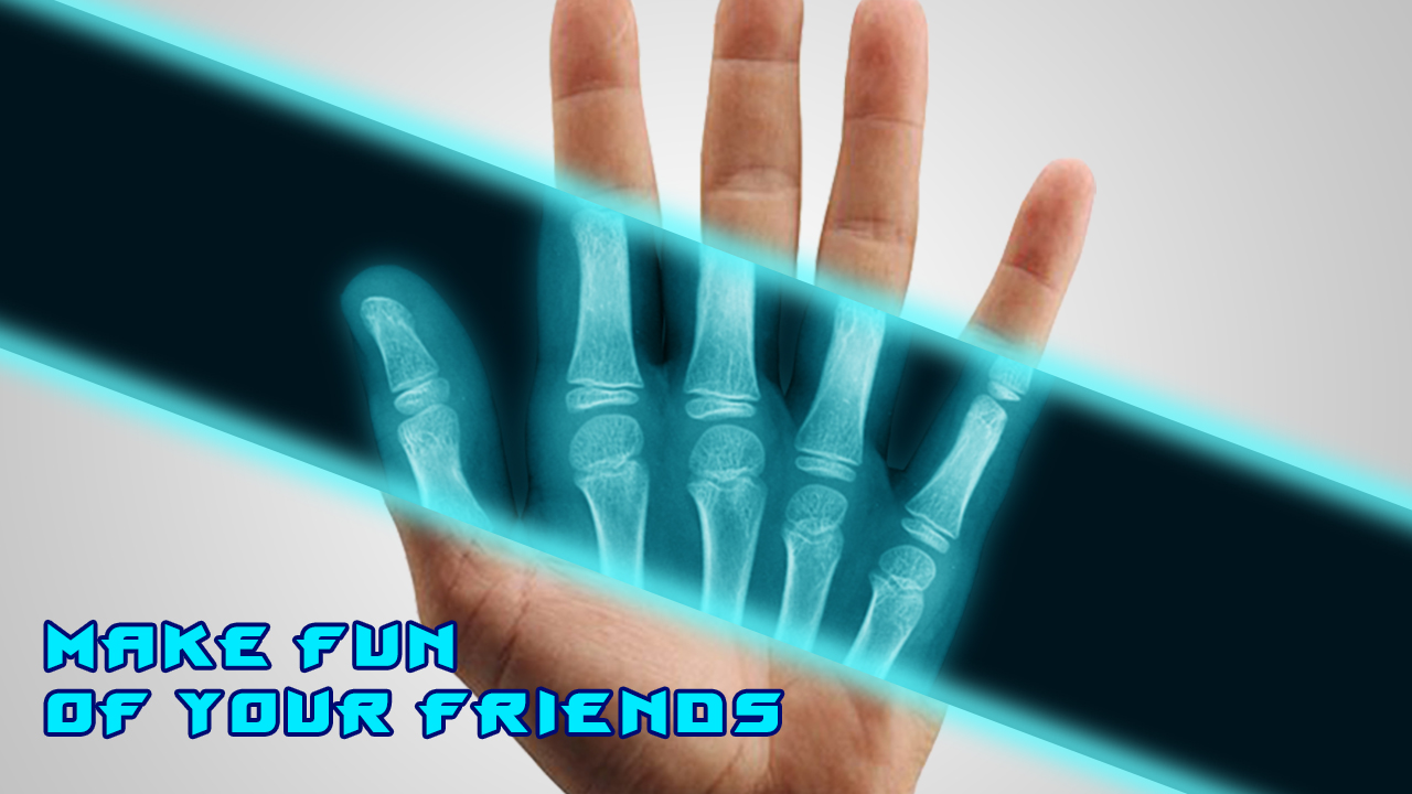 Best X-Ray FREE - App on Amazon Appstore