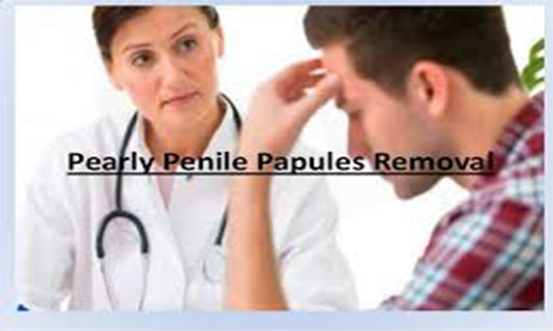 Pearly Papules Removal - App on Amazon Appstore