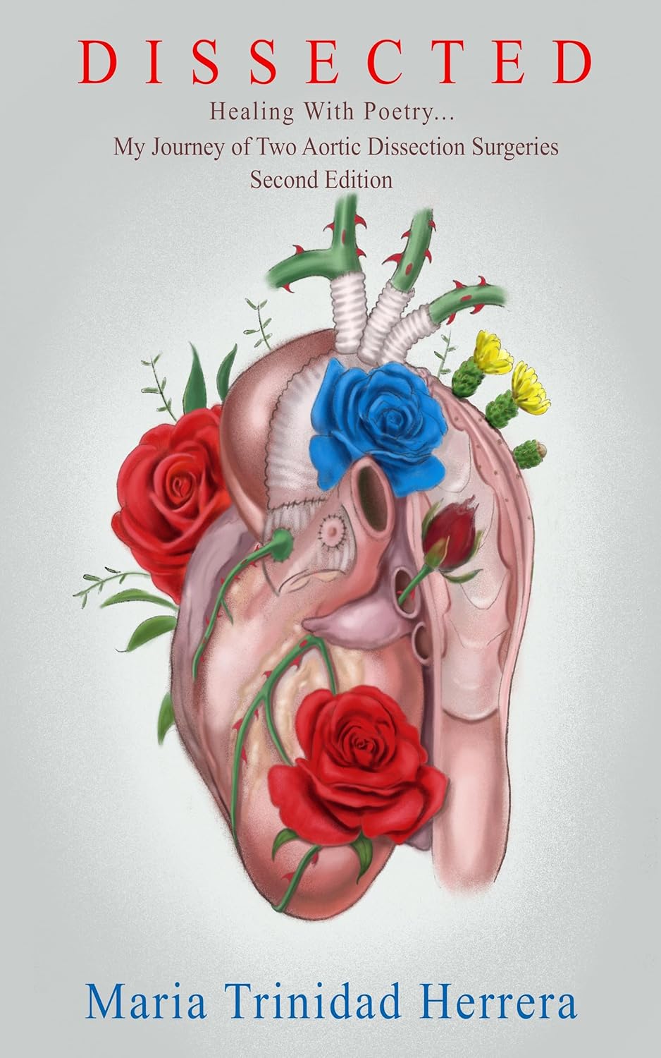 Amazon.com: Dissected: Healing With Poetry... My Journey of Two Aortic ...