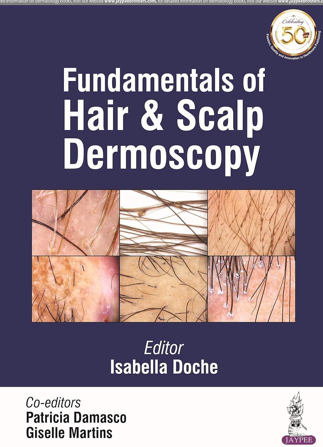 Fundamentals of Hair and Scalp Dermoscopy: 9789352705610: Medicine ...
