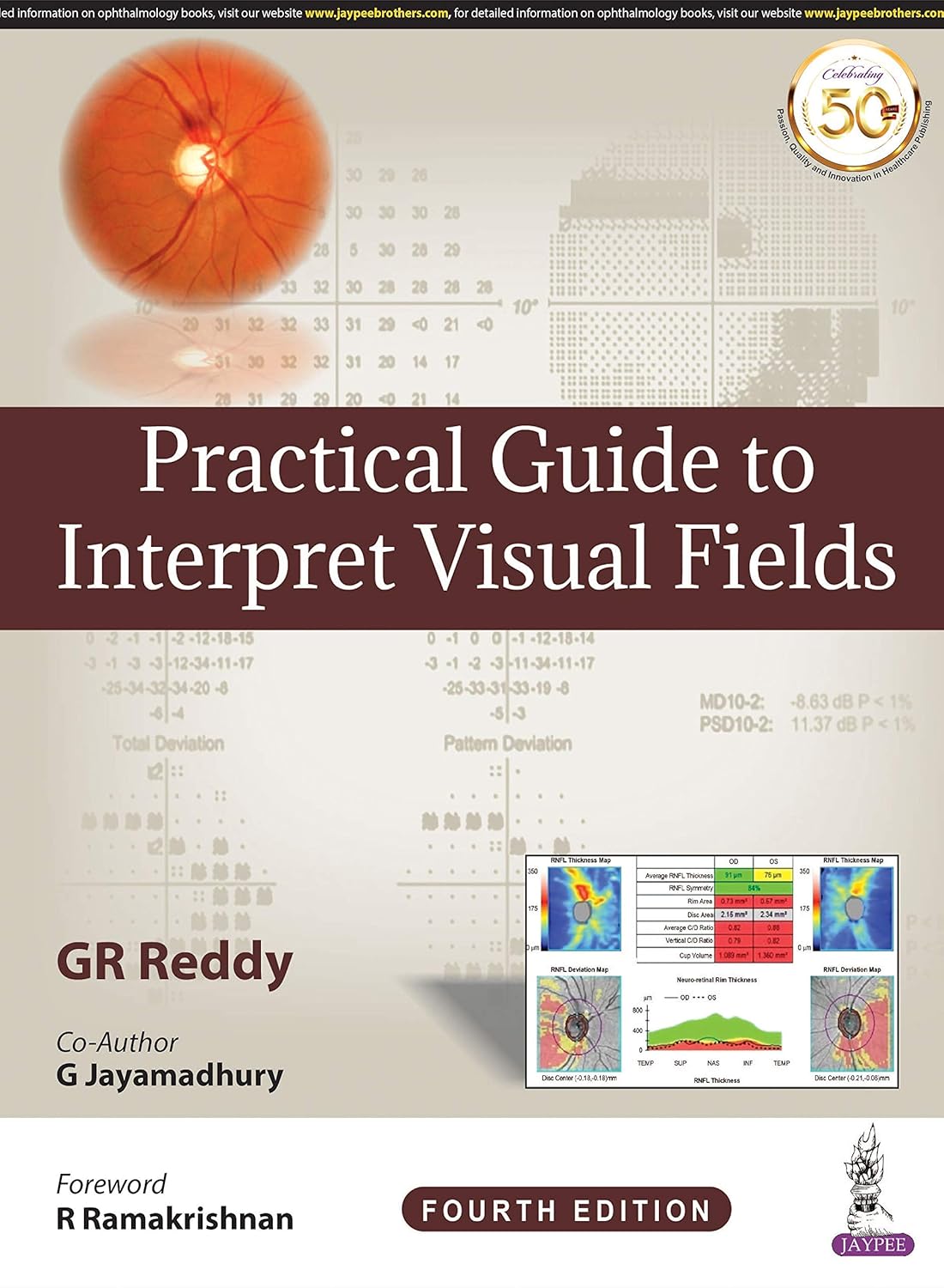 PRACTICAL GUIDE TO INTERPRET VISUAL FIELDs: 9789389587012: Medicine ...