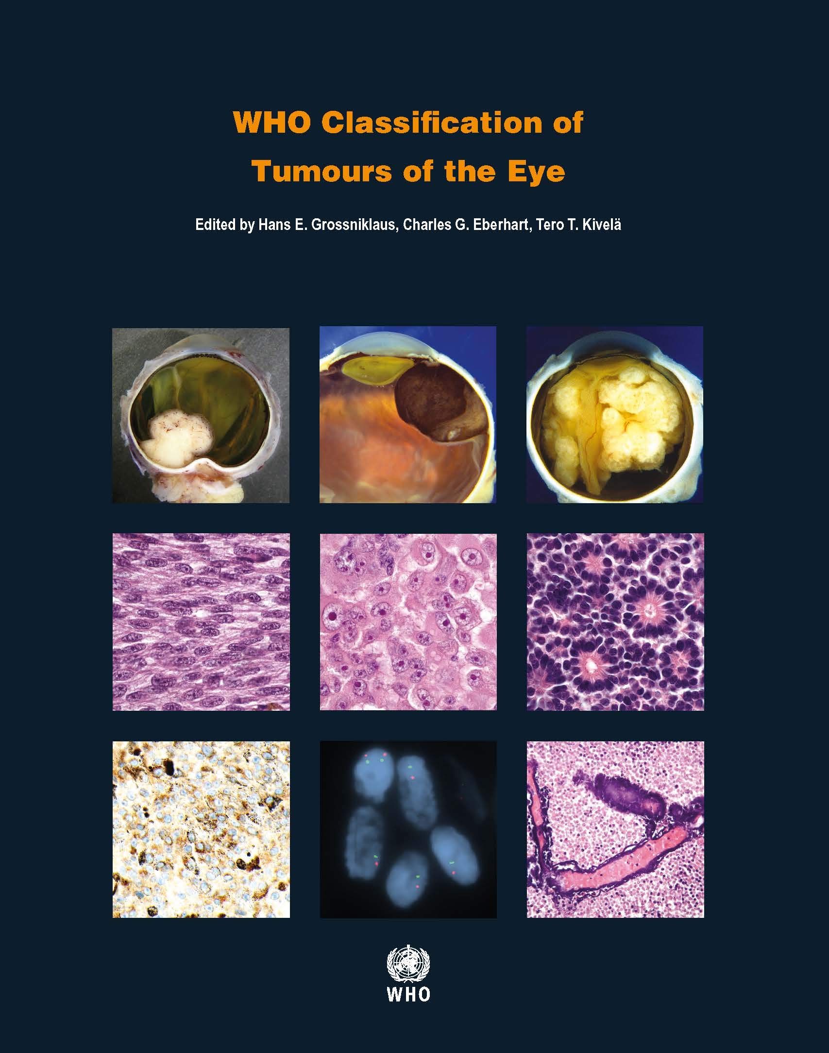 Buy WHO classification of tumours of the eye (World Organization ...
