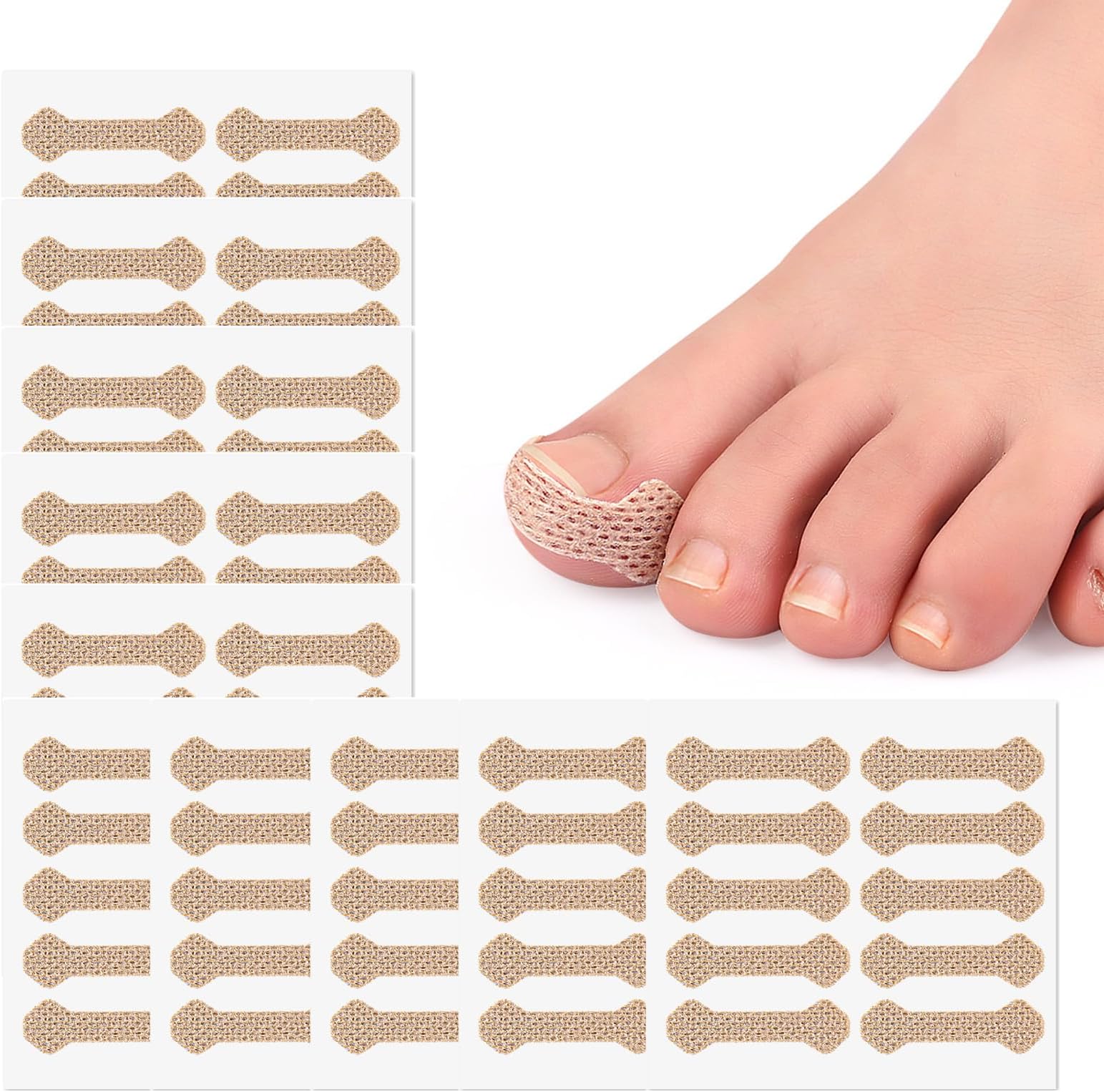 Amazon.com: 100 pcs Breathable Ingrown Toenail Strips, Toenail ...