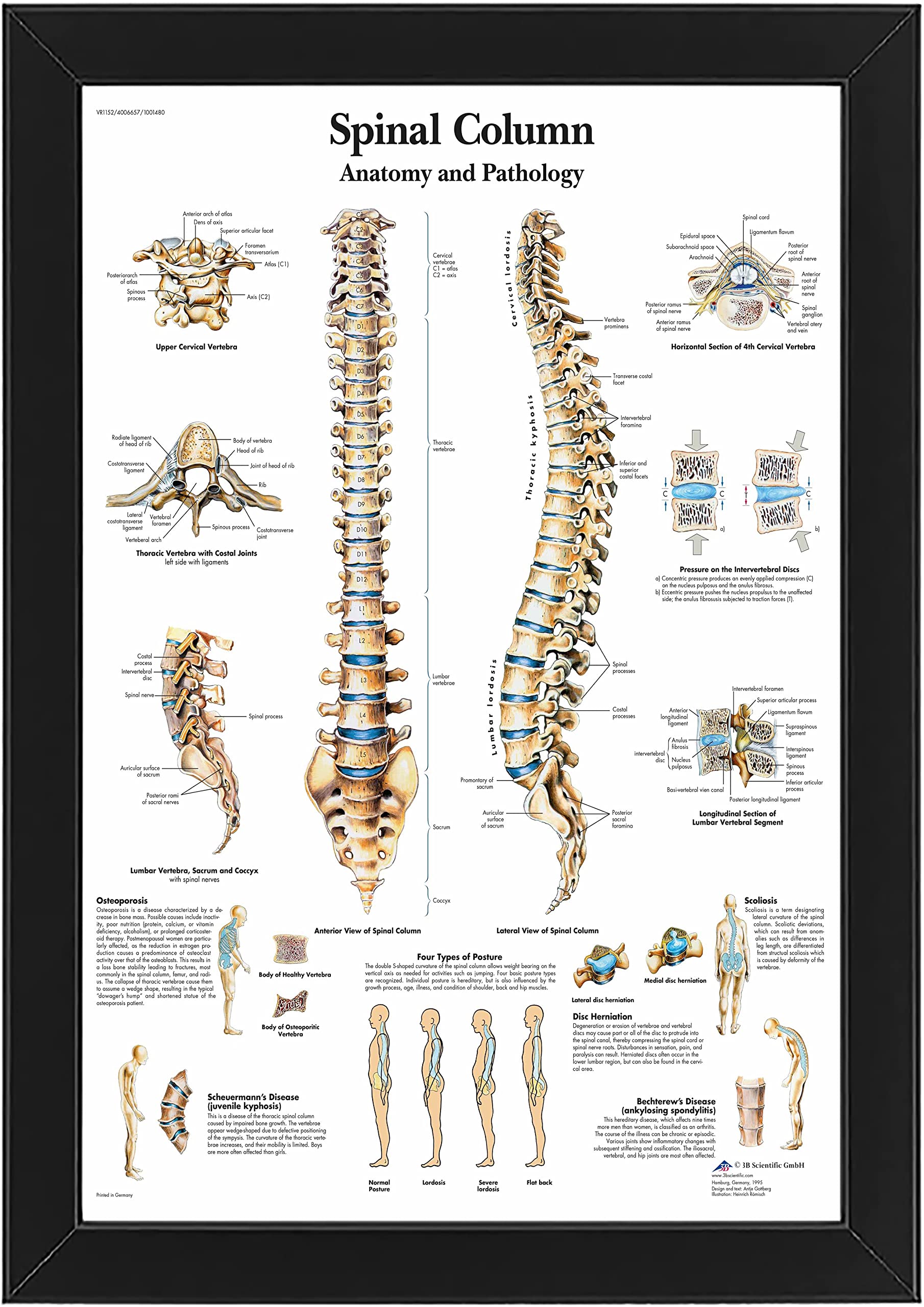 New Anatomical Spinal Column Diagram Chart Spine Anatomy Print Palace