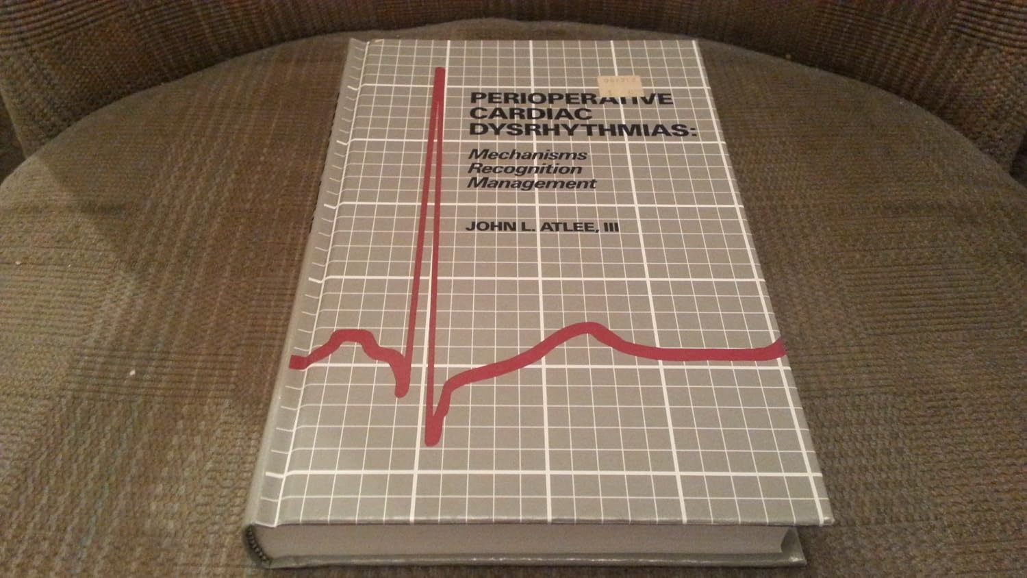 Perioperative cardiac dysrhythmias: Mechanisms, recognition, management ...