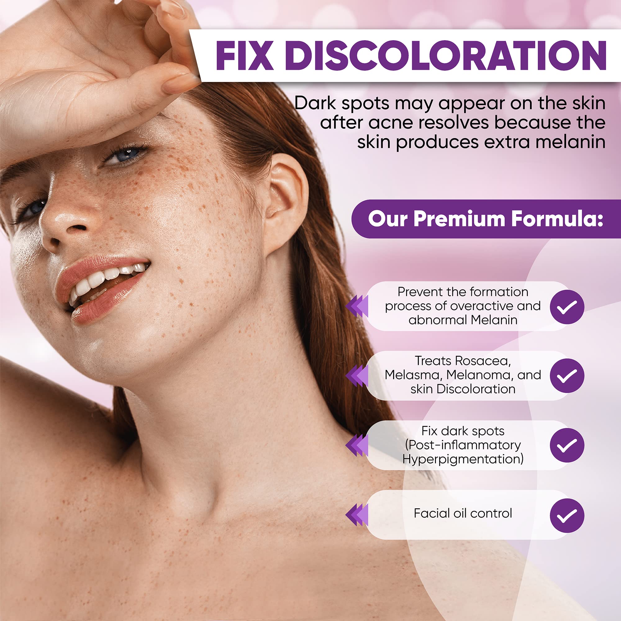 Snapklik.com : AOBBIY 10% Azelaic Acid Cream: Acne Treatment - Acne ...