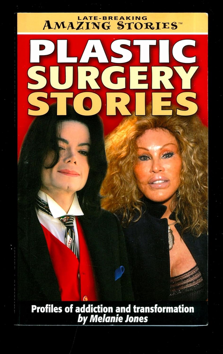 Amazon | Plastic Surgery Stories: Profiles of Addiction and ...