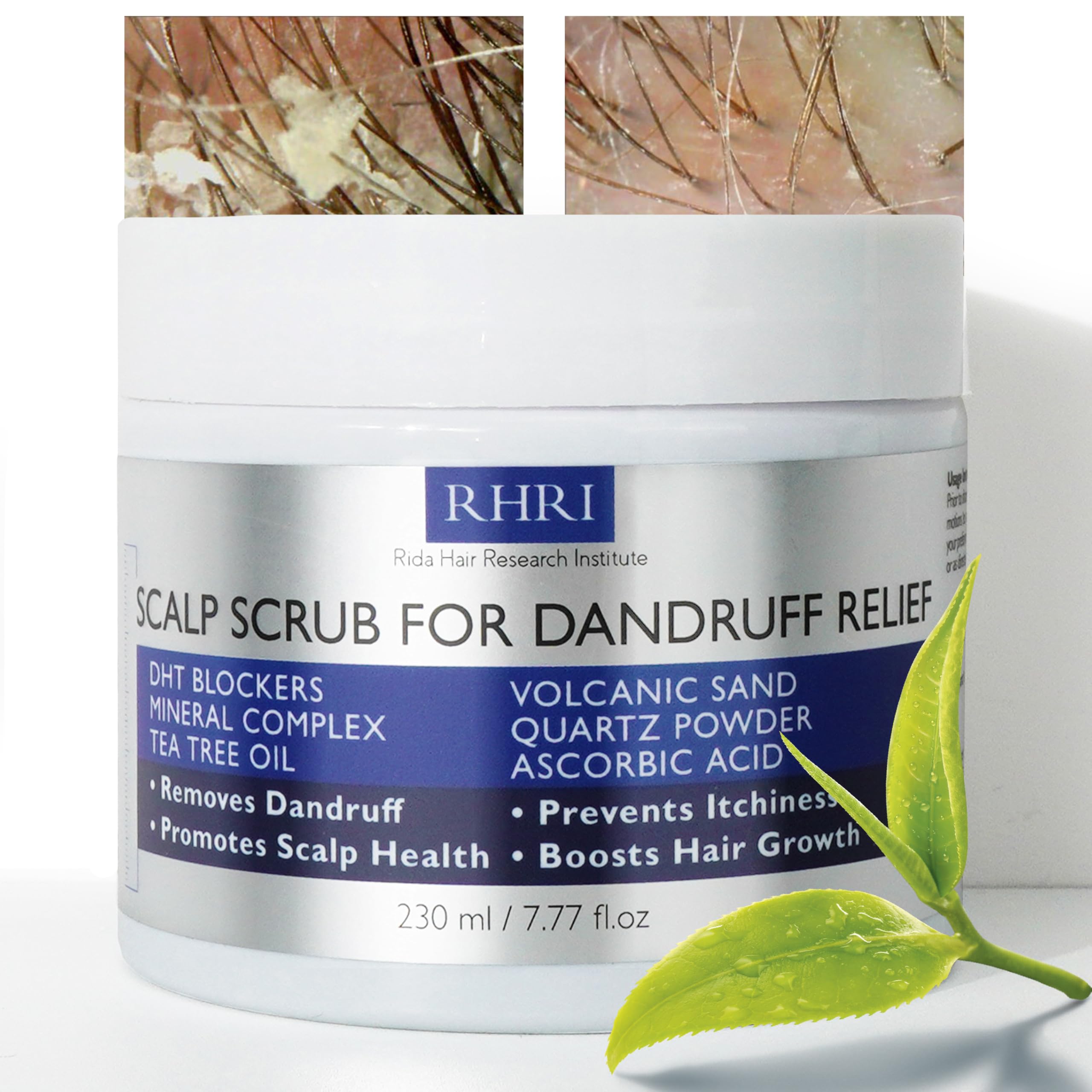 Amazon.com : Anti Dandruff Scalp Scrub for Men and Women | Hair ...