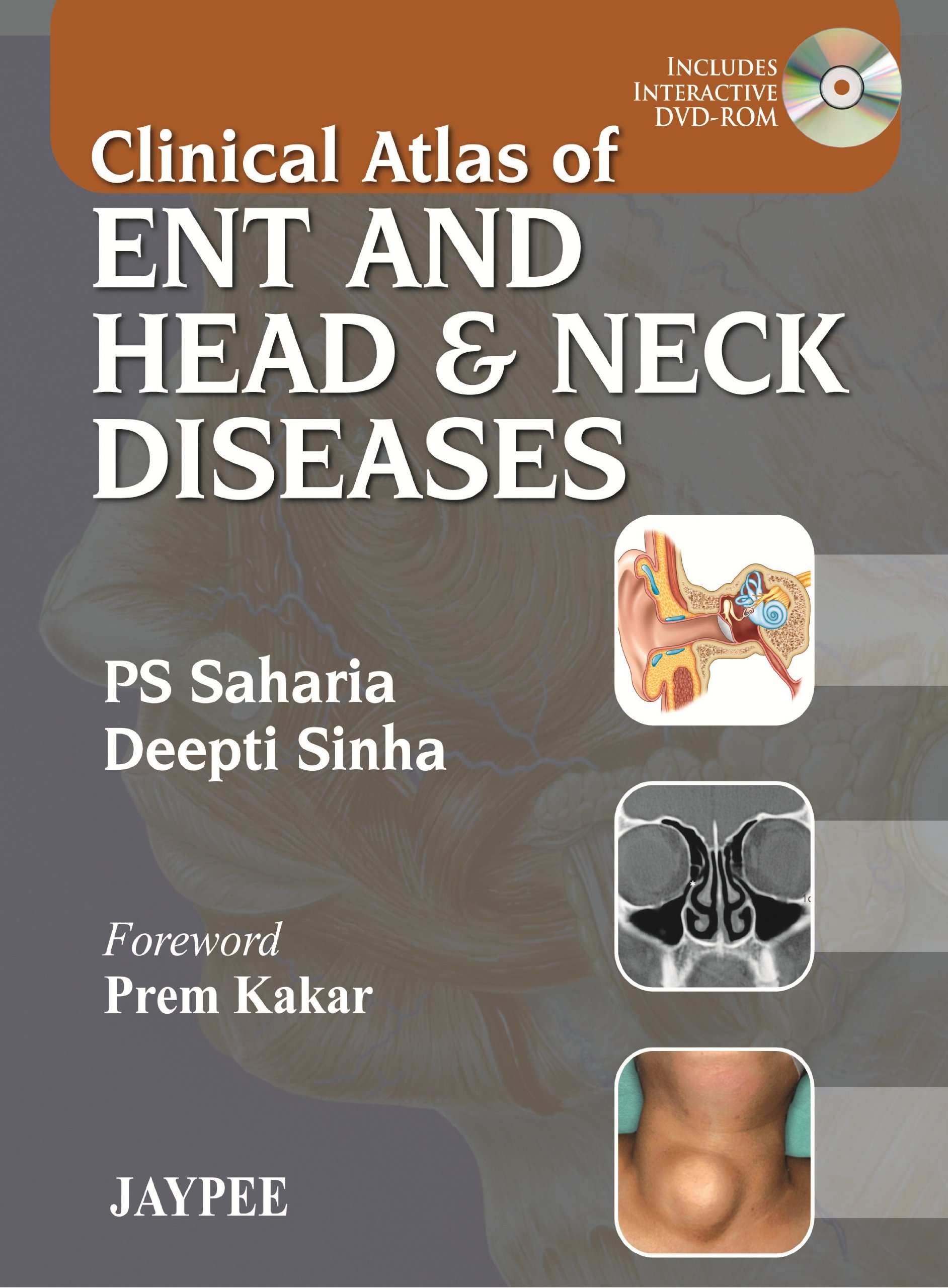 Buy Clinical Atlas of ENT and Head & Neck Diseases Book Online at Low ...