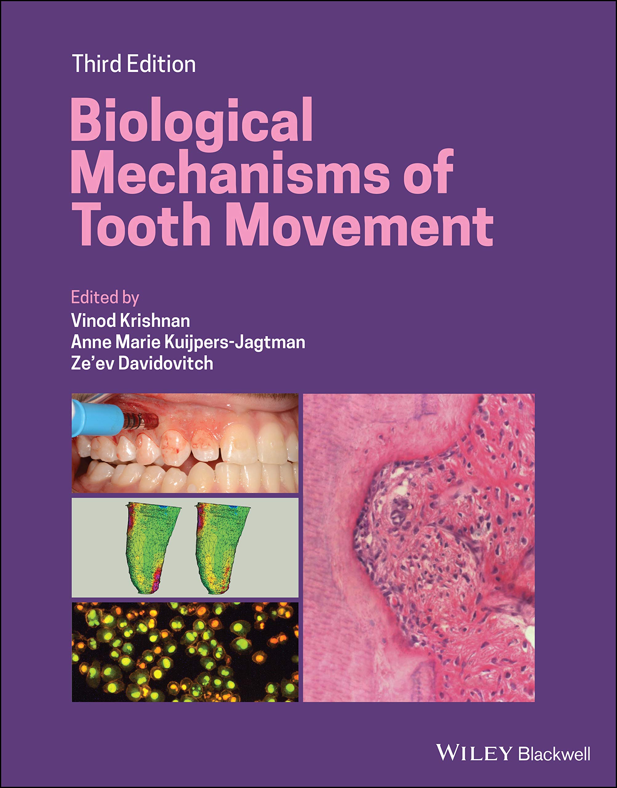 Snapklik.com : Biological Mechanisms Of Tooth Movement