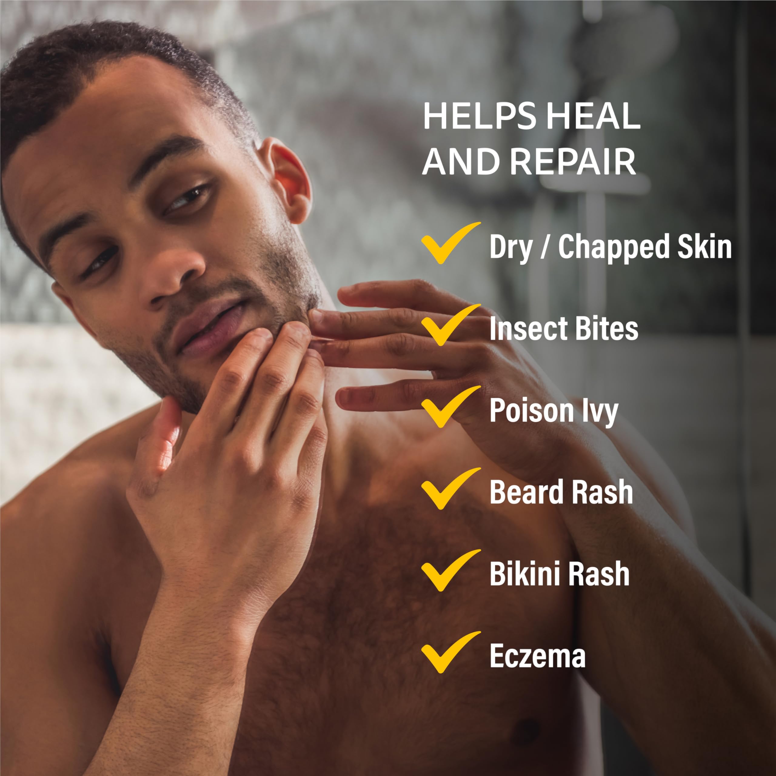 Snapklik.com : A+D Medicated Rash Ointment 1.5 Oz Relieves Rash & Skin ...