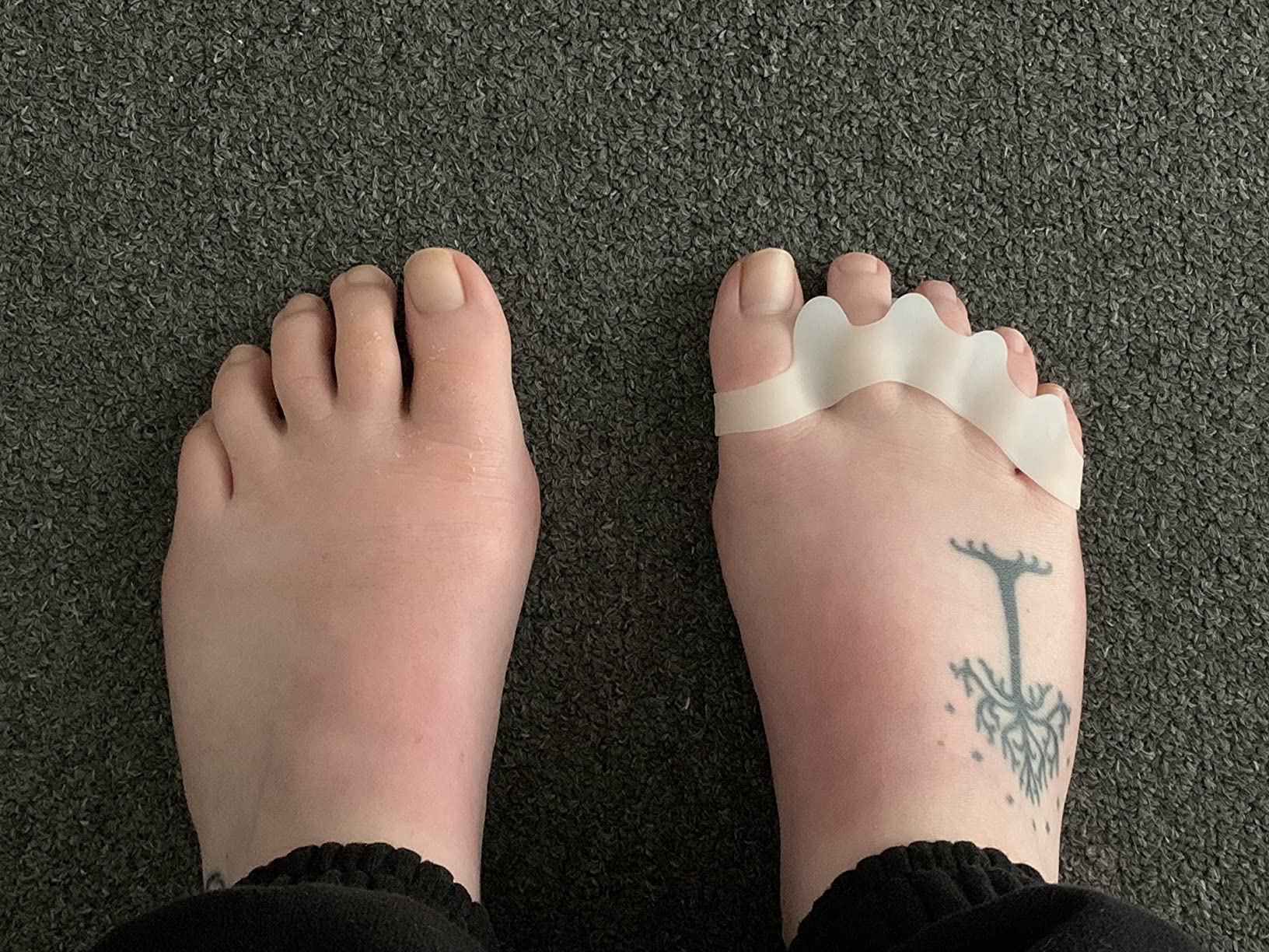 Gel Toe Separator, Bestrice Toe Spacers Rubber Toe Stretchers Used for ...