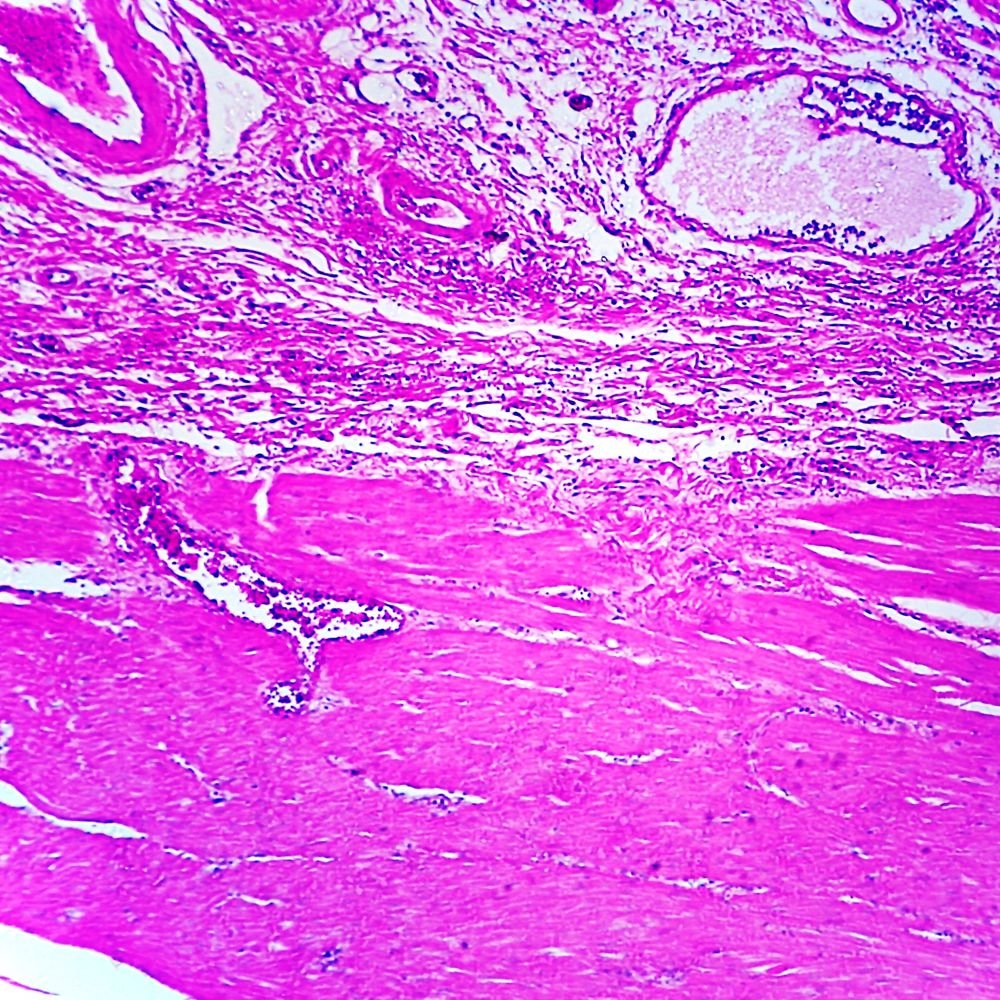 Stomach Microscope Slide