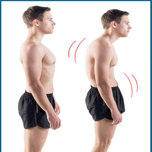 3 Ways to Correct Forward Head Posture - App on the Amazon Appstore