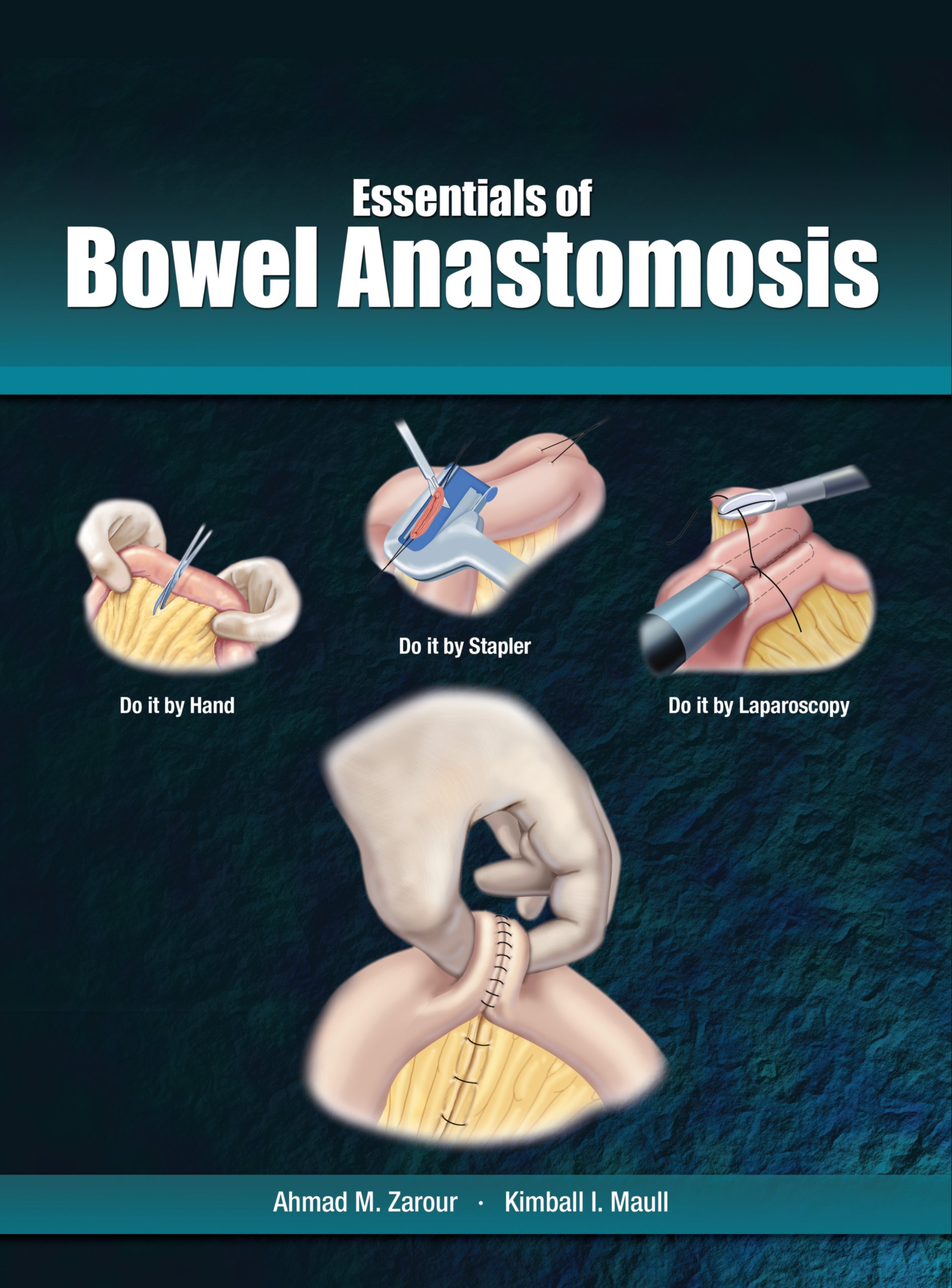 Essentials of Bowel Anastomosis: 9780984617197: Medicine & Health ...
