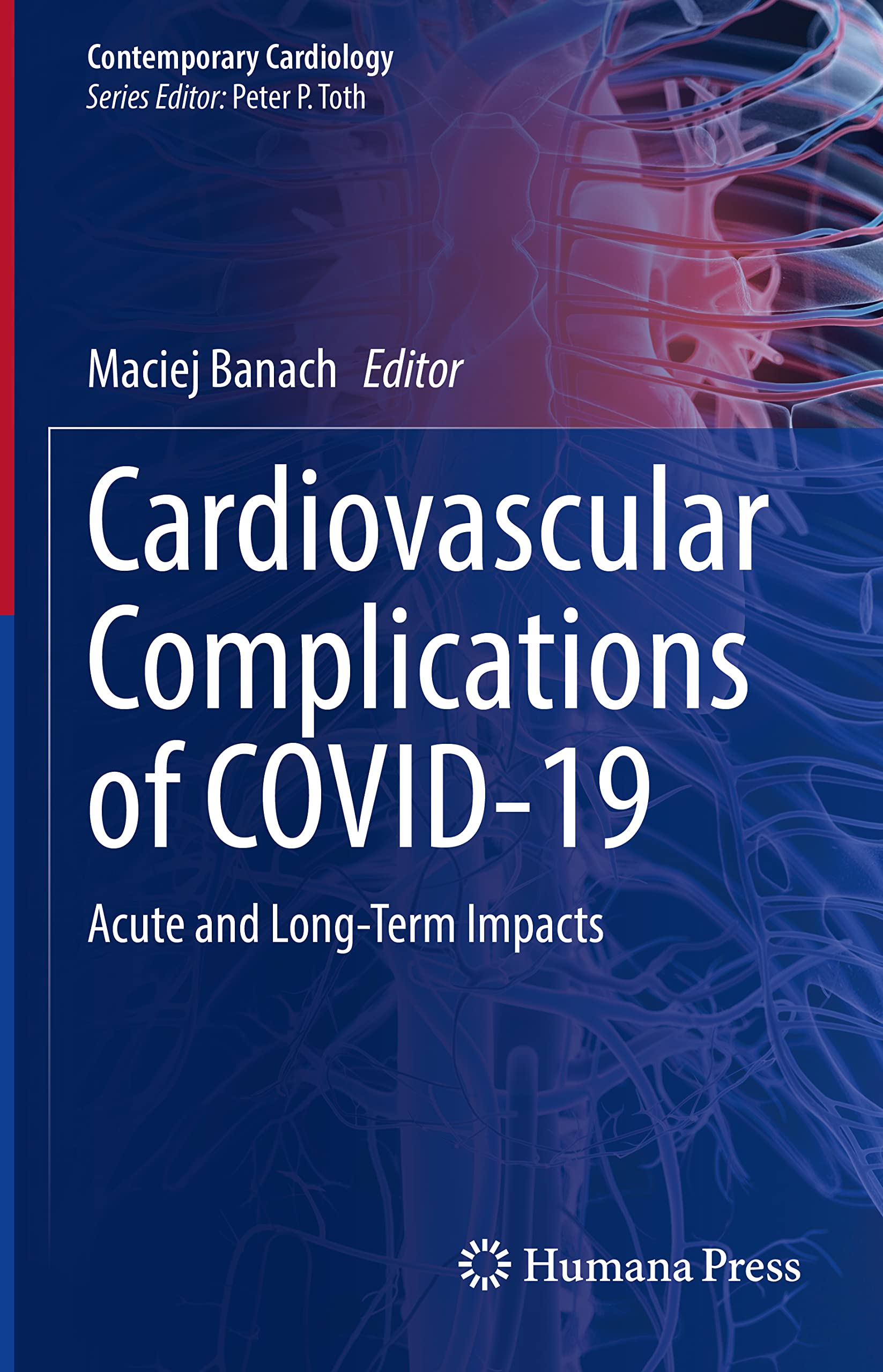 Cardiovascular Complications of COVID-19: Acute and Long-Term Impacts ...