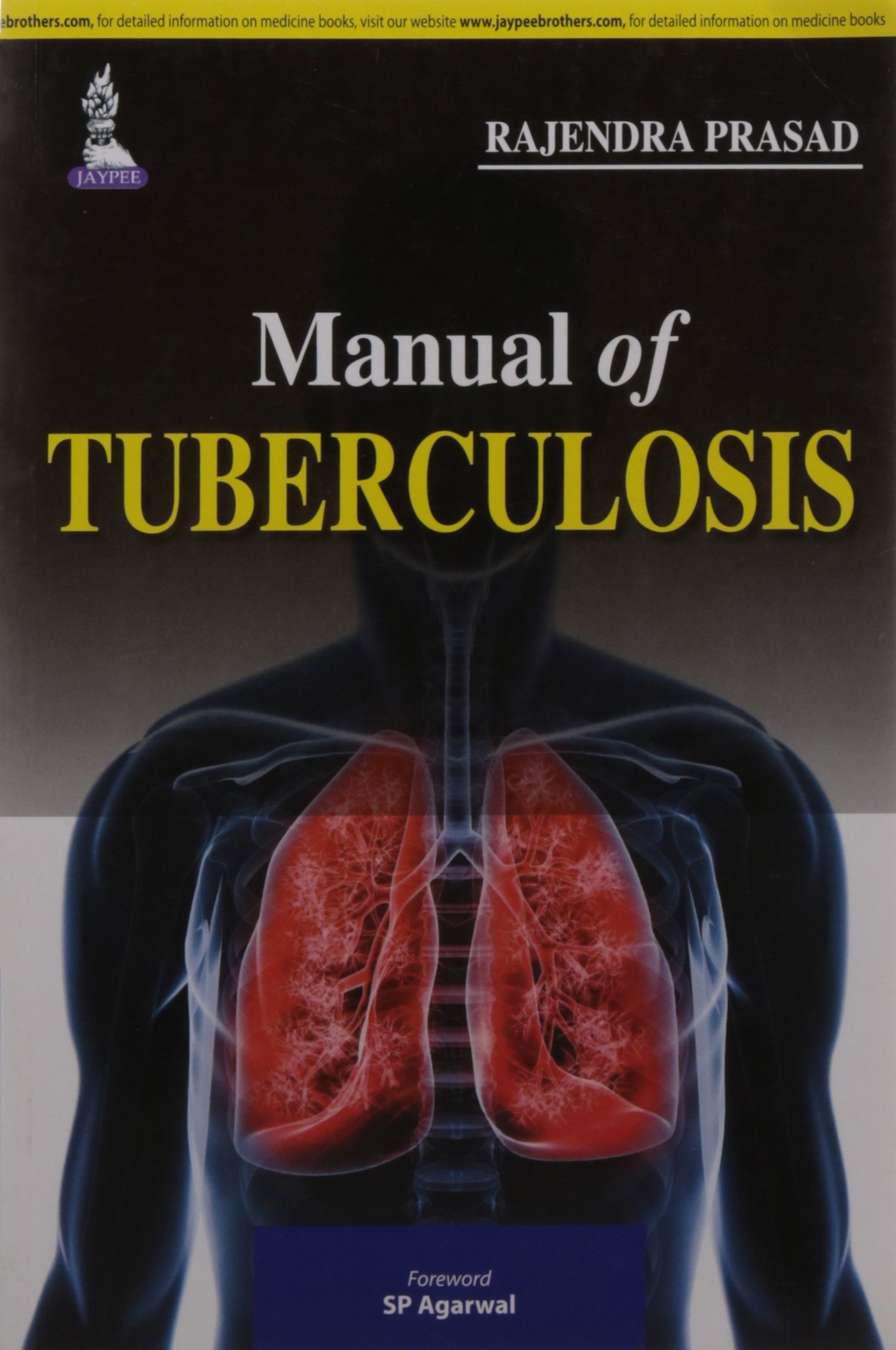 Buy Manual of Tuberculosis Book Online at Low Prices in India | Manual ...