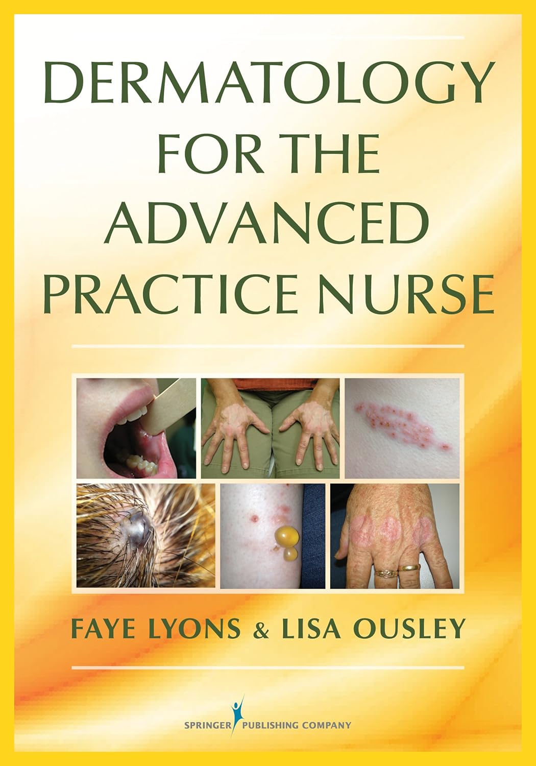 Dermatology for the Advanced Practice Nurse: 9780826136435: Medicine ...