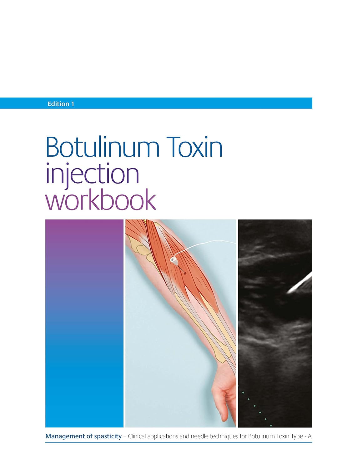 Buy Botulinum Toxin Injection Workbook: Spasticity: Clinical ...