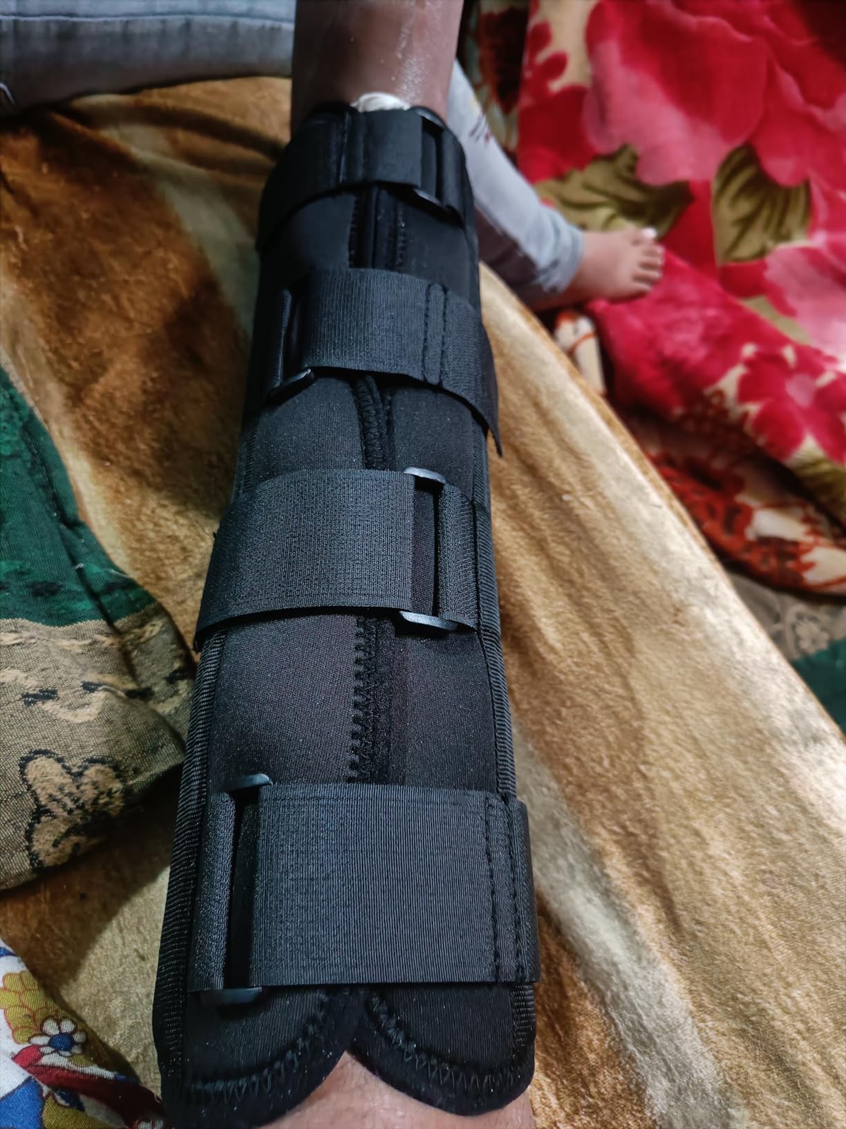 Buy TIBIAL BRACE | SUPPORT FOR LEG, CALF AND FIBULA FRACTURE ORTHOSIS ...