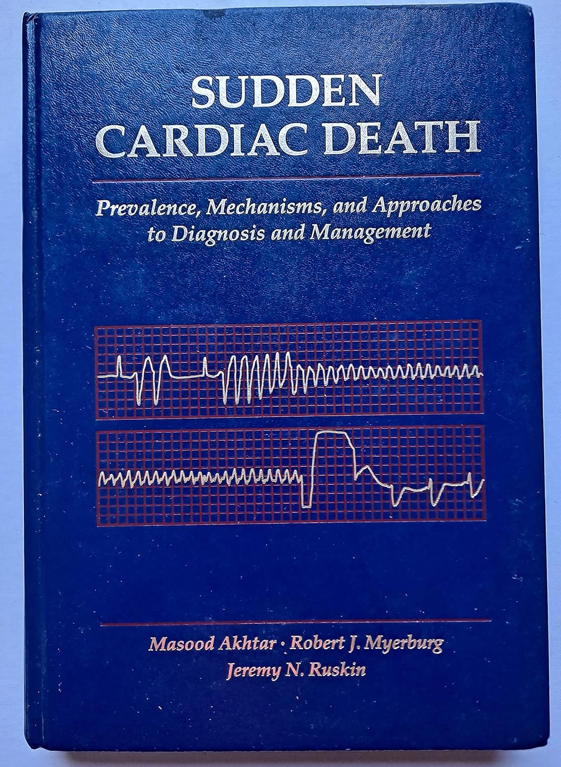 Amazon | Sudden Cardiac Death: Prevalence, Mechanisms and Approaches to ...