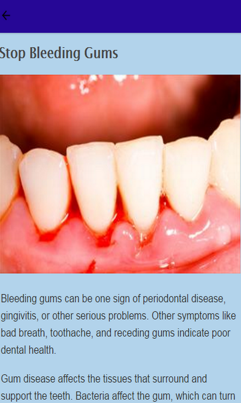 how to stop bleeding gums - App on the Amazon Appstore