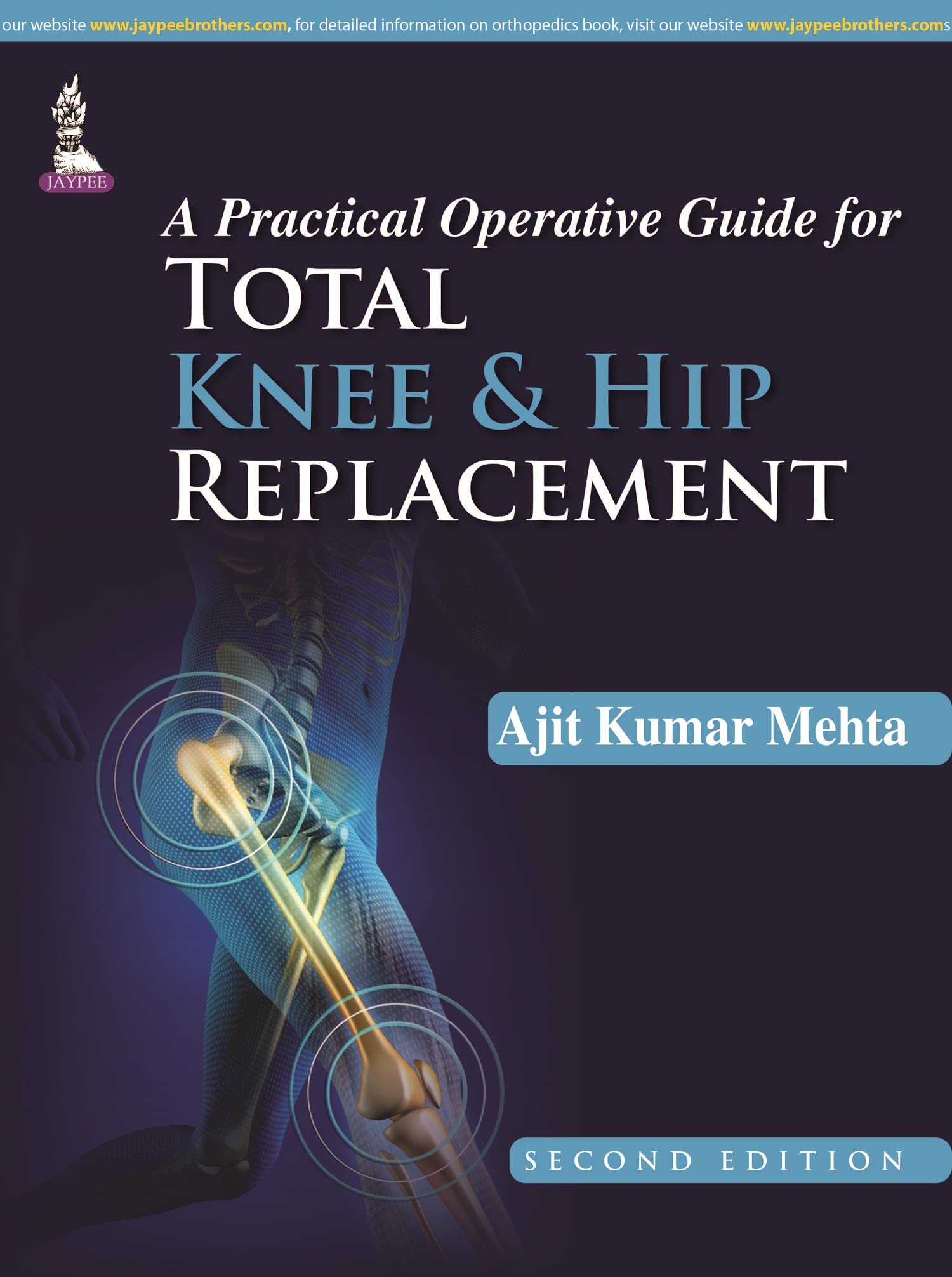 A Practical Operative Guide for Total Knee and Hip Replacement ...