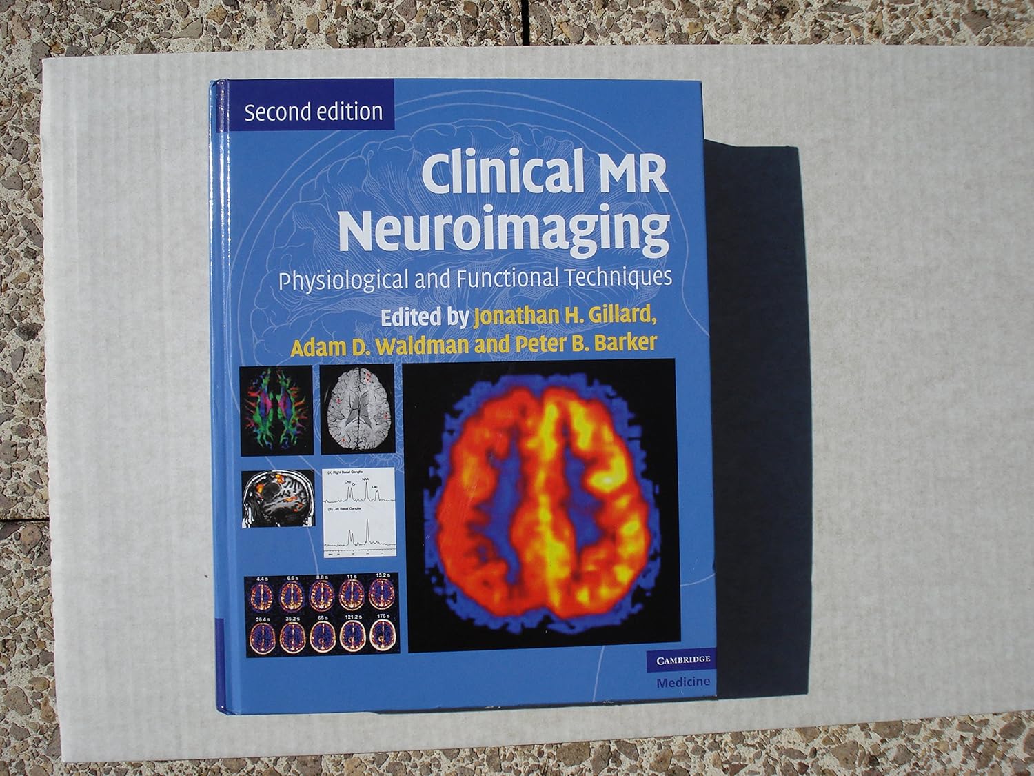 Clinical MR Neuroimaging: Physiological and Functional Techniques ...