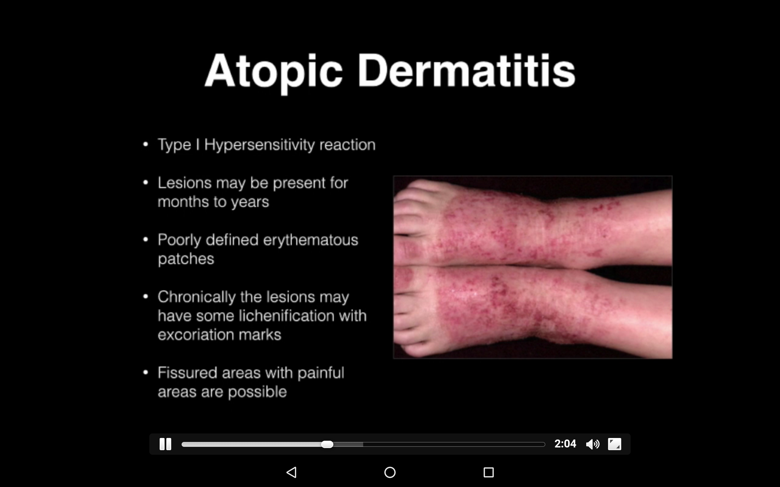 Dermatology Preview PANCE Review Course Free - App on Amazon Appstore