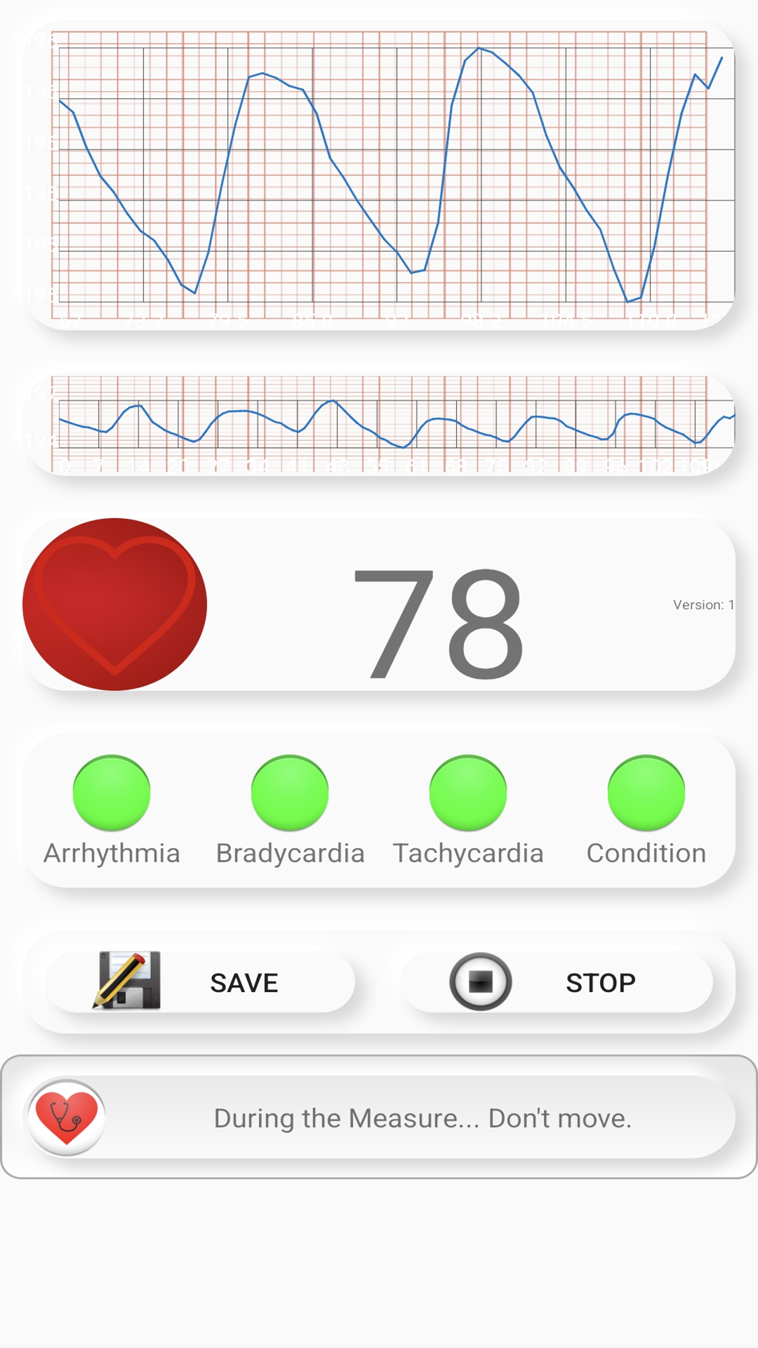 Cardiac Diagnosis - App on Amazon Appstore