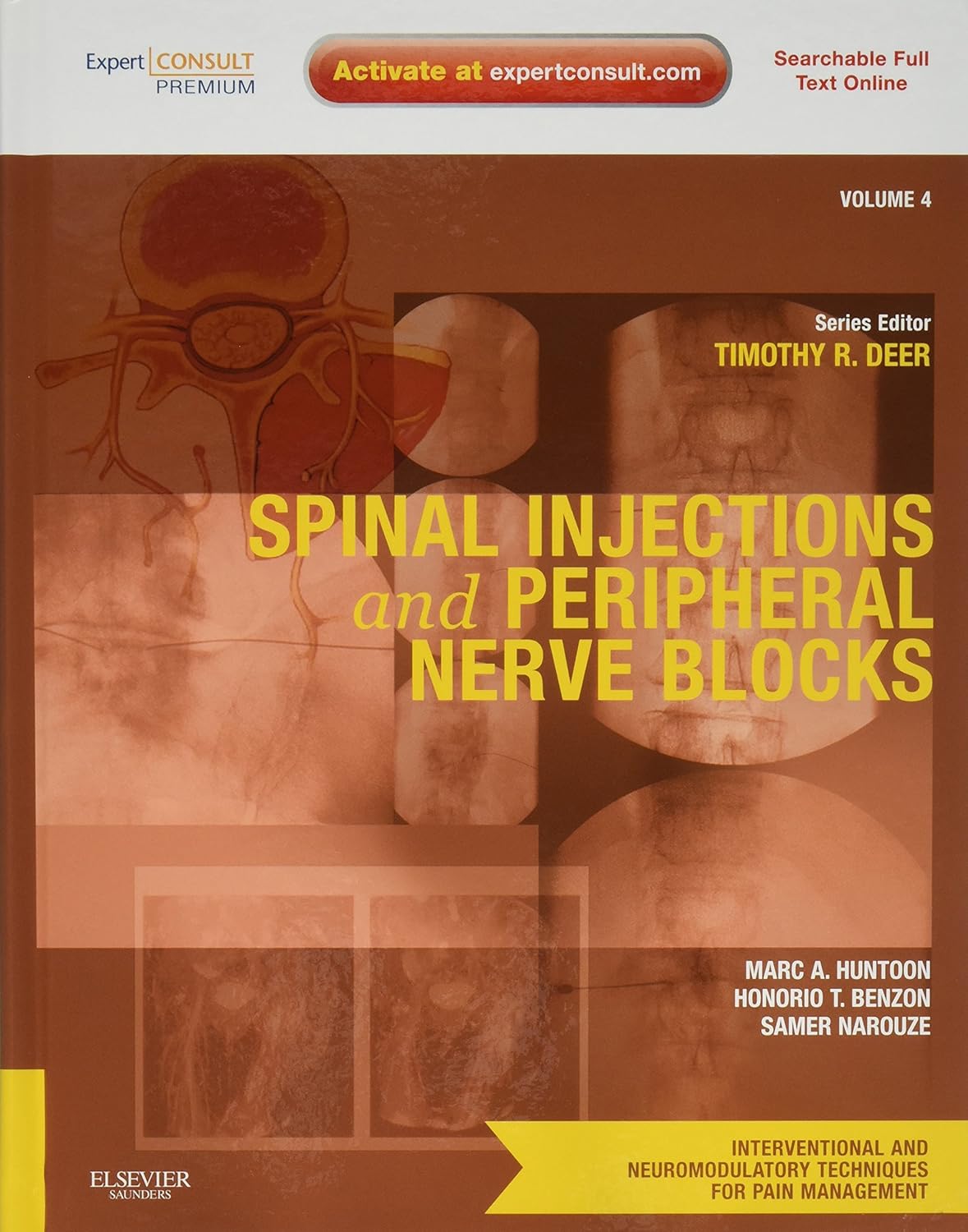 Spinal Injections & Peripheral Nerve Blocks: Volume 4: A Volume in the ...